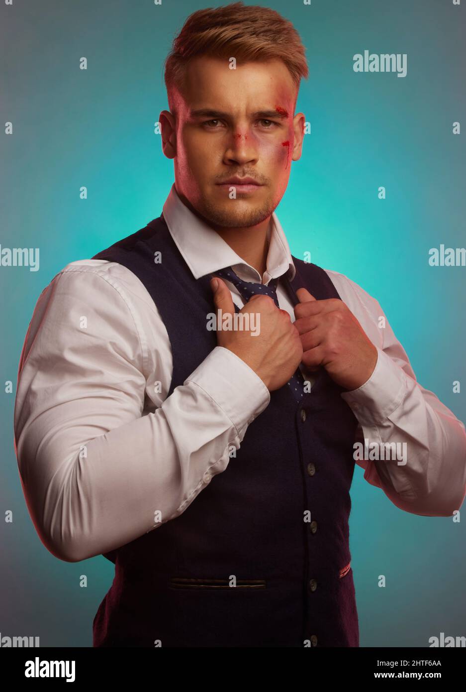 No one needs to know how I got these bruises. Shot of a handsome young ...