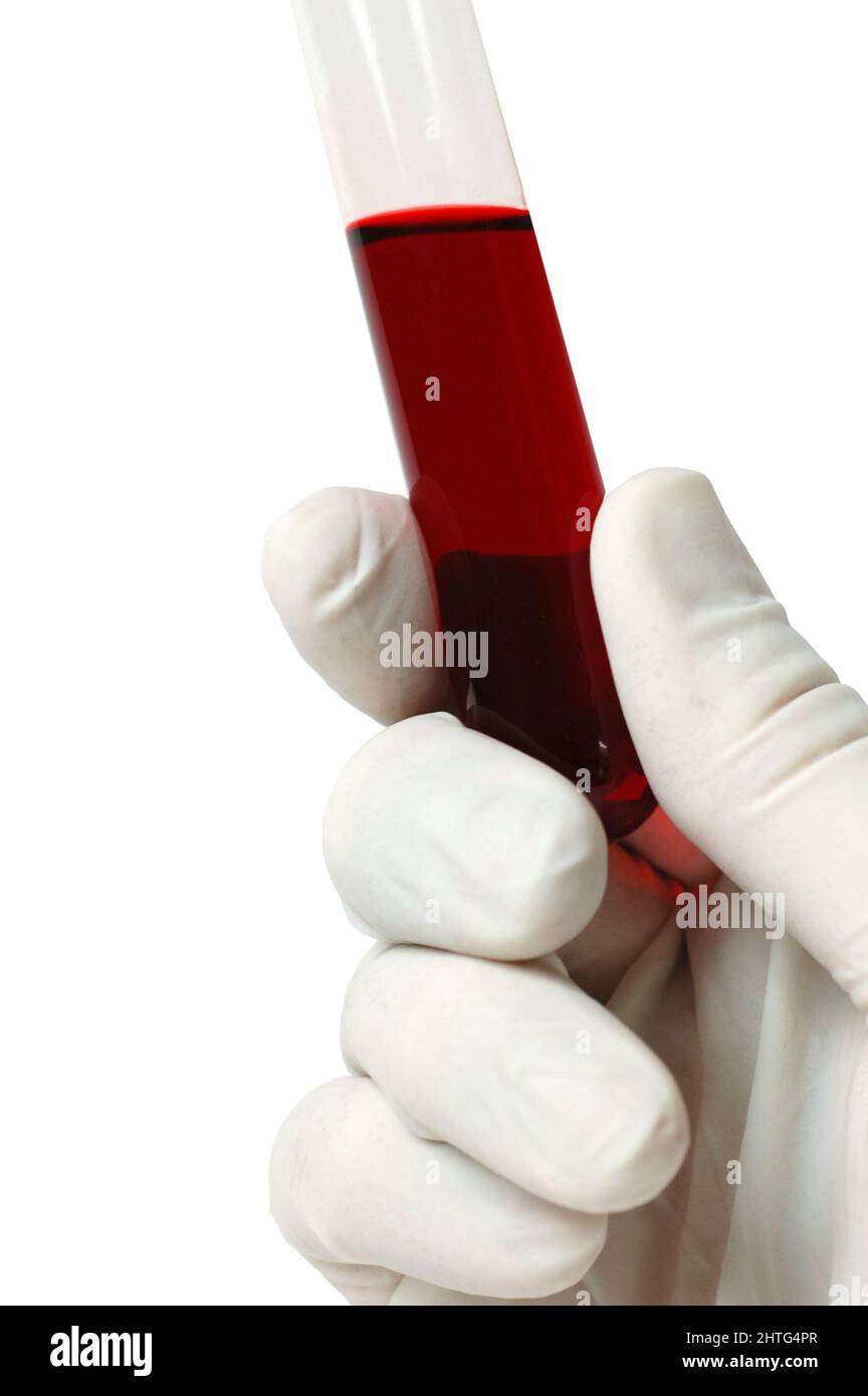 Hand of laboratory technician holding test tube with blood Stock Photo ...
