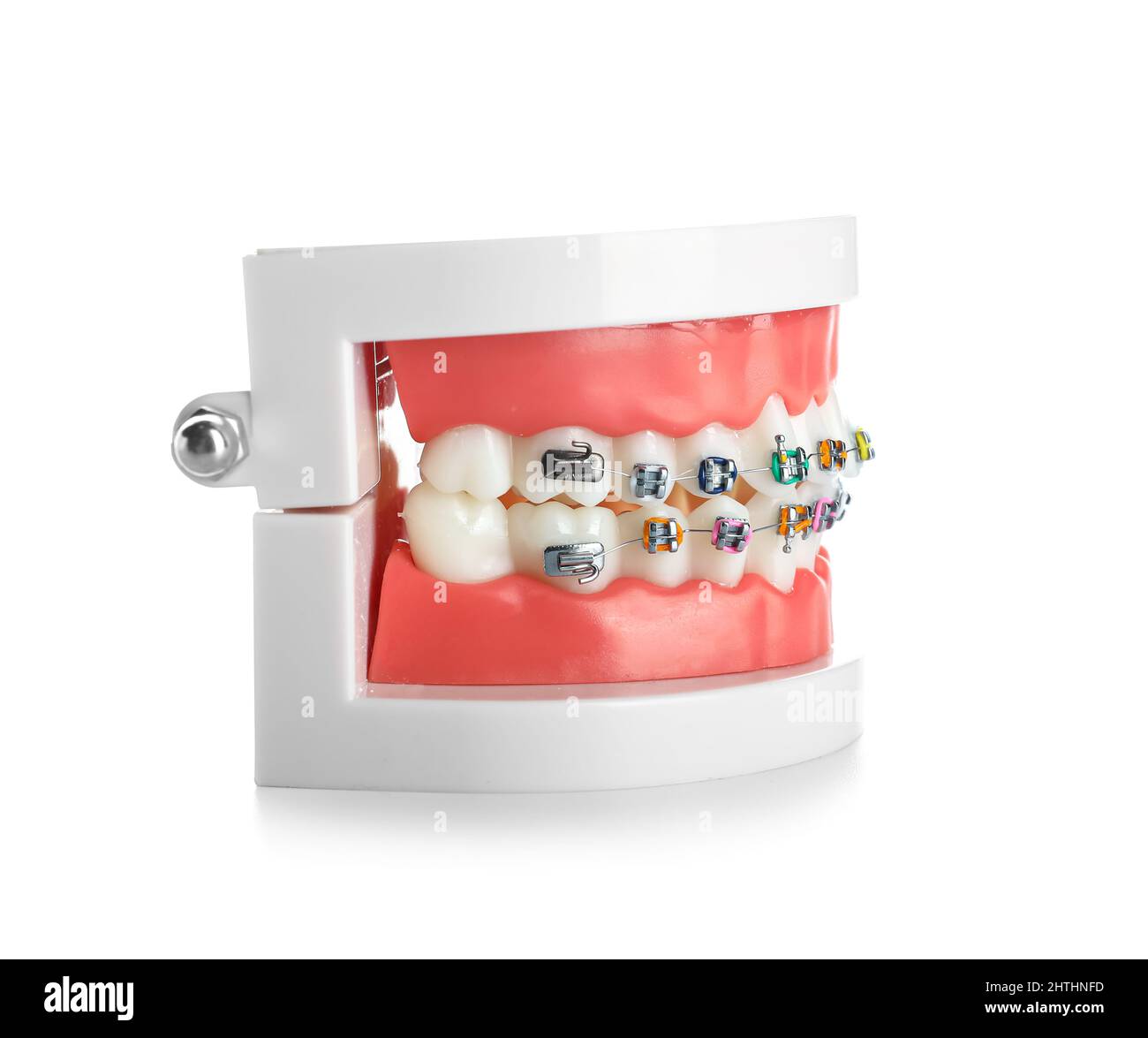 Model of jaw with braces isolated on white background Stock Photo - Alamy