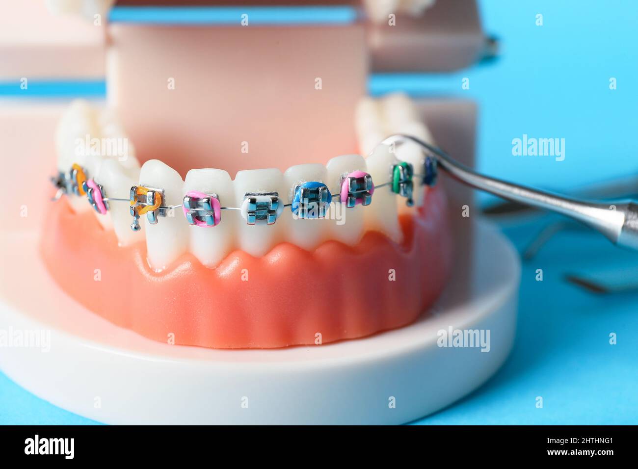 Model of jaw with braces on blue background, closeup Stock Photo - Alamy