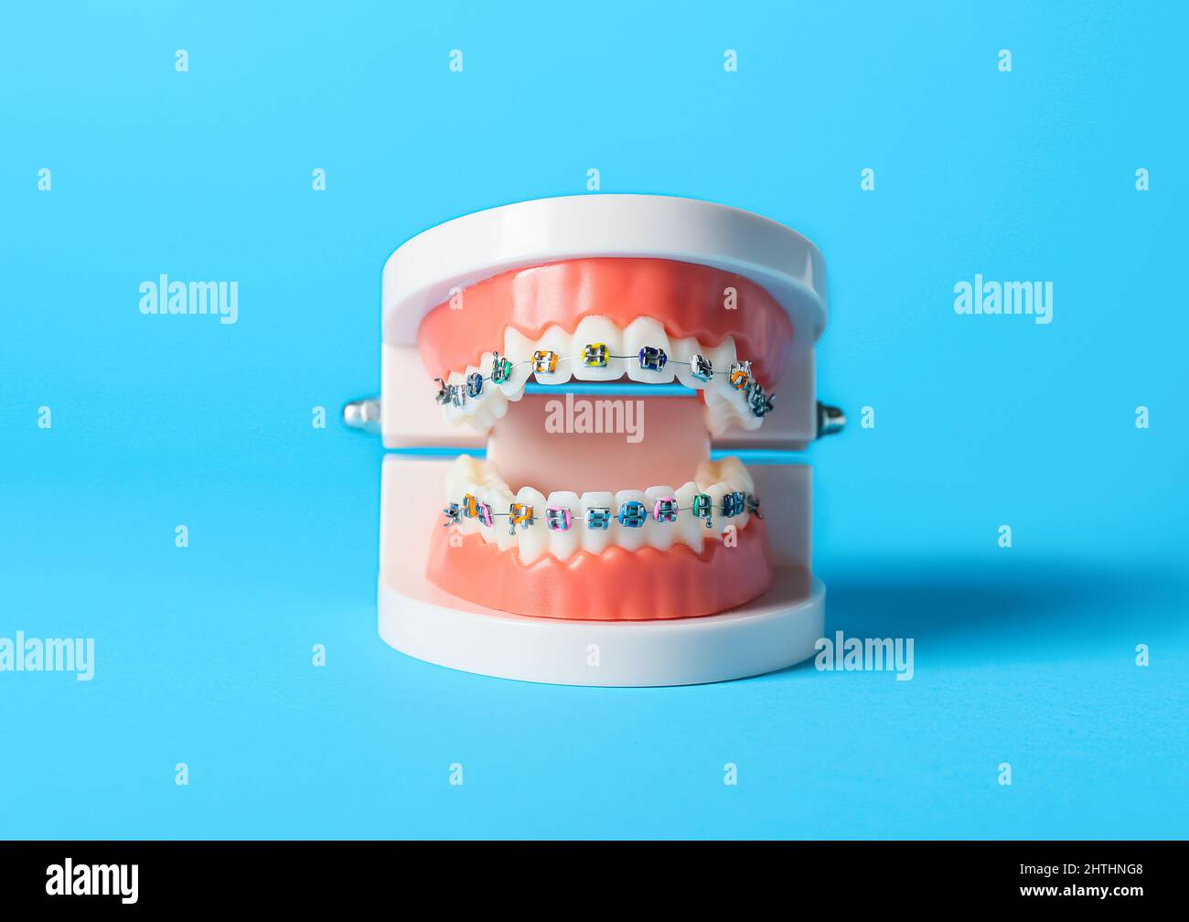 Model of jaw with braces on blue background Stock Photo - Alamy