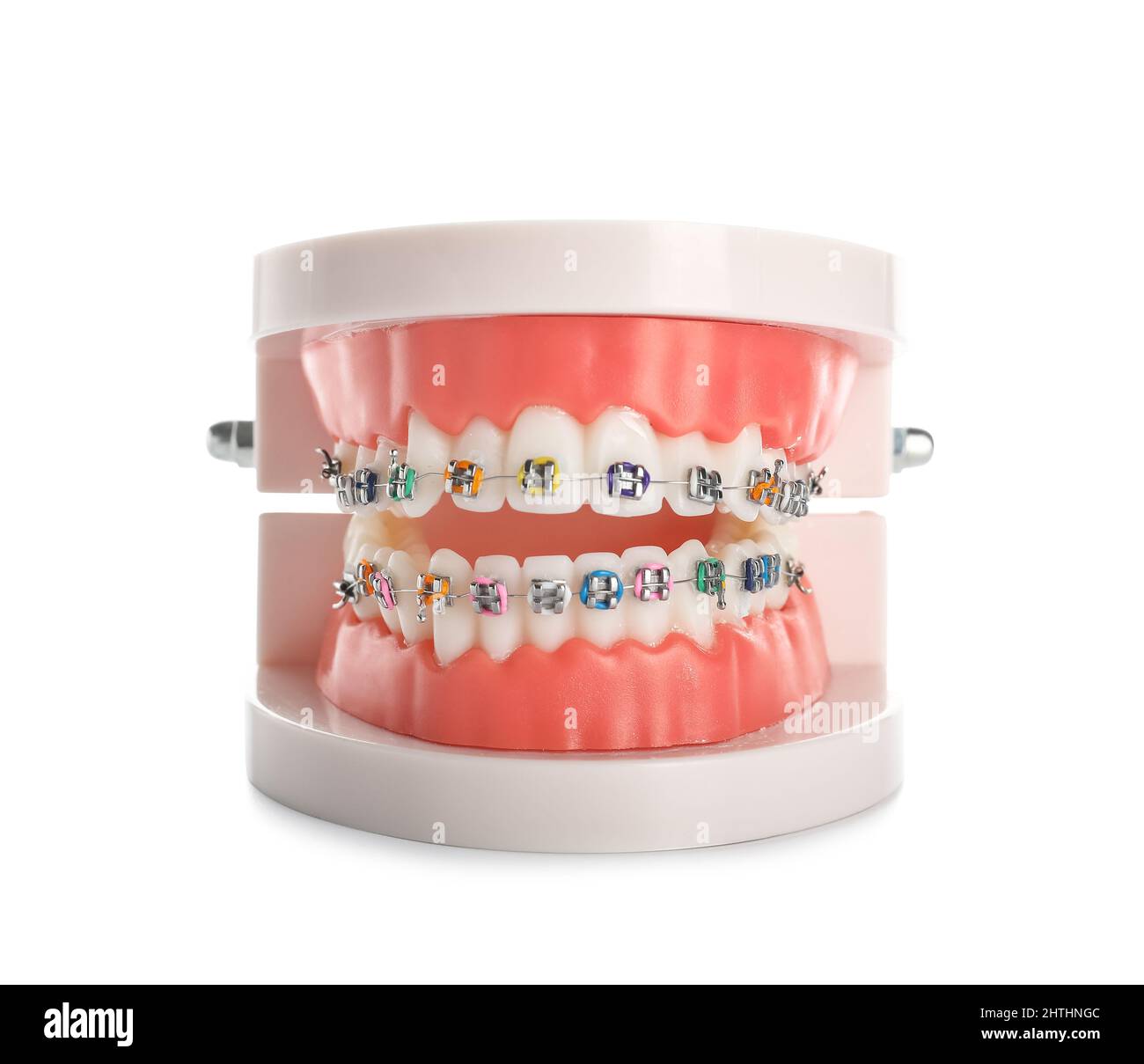 Model of jaw with braces isolated on white background Stock Photo - Alamy