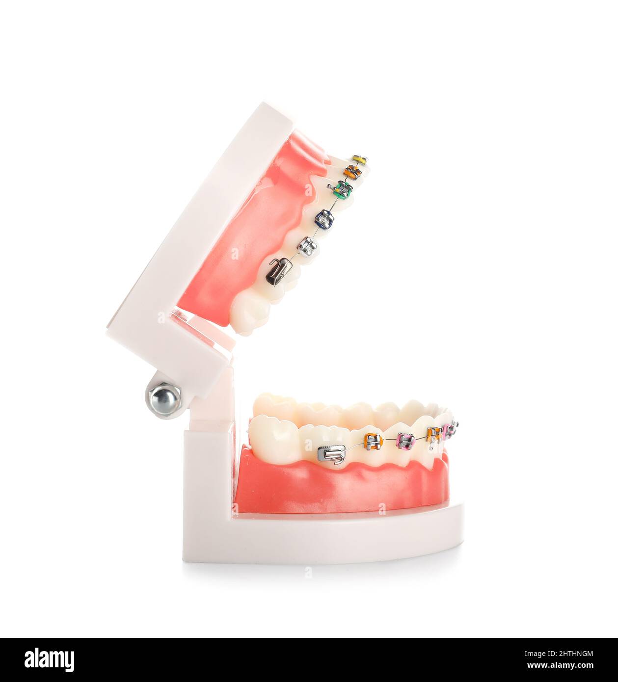 Model of jaw with braces isolated on white background Stock Photo - Alamy