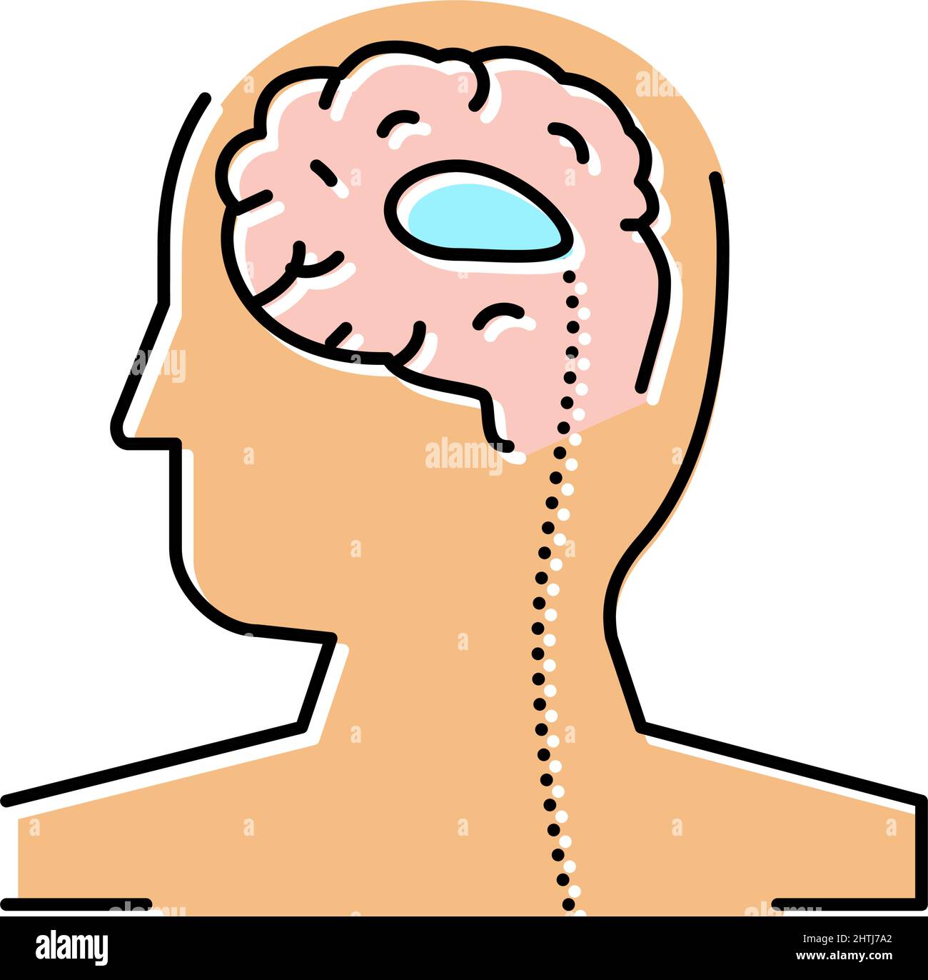 shunt insertion or revision color icon vector illustration Stock Vector ...