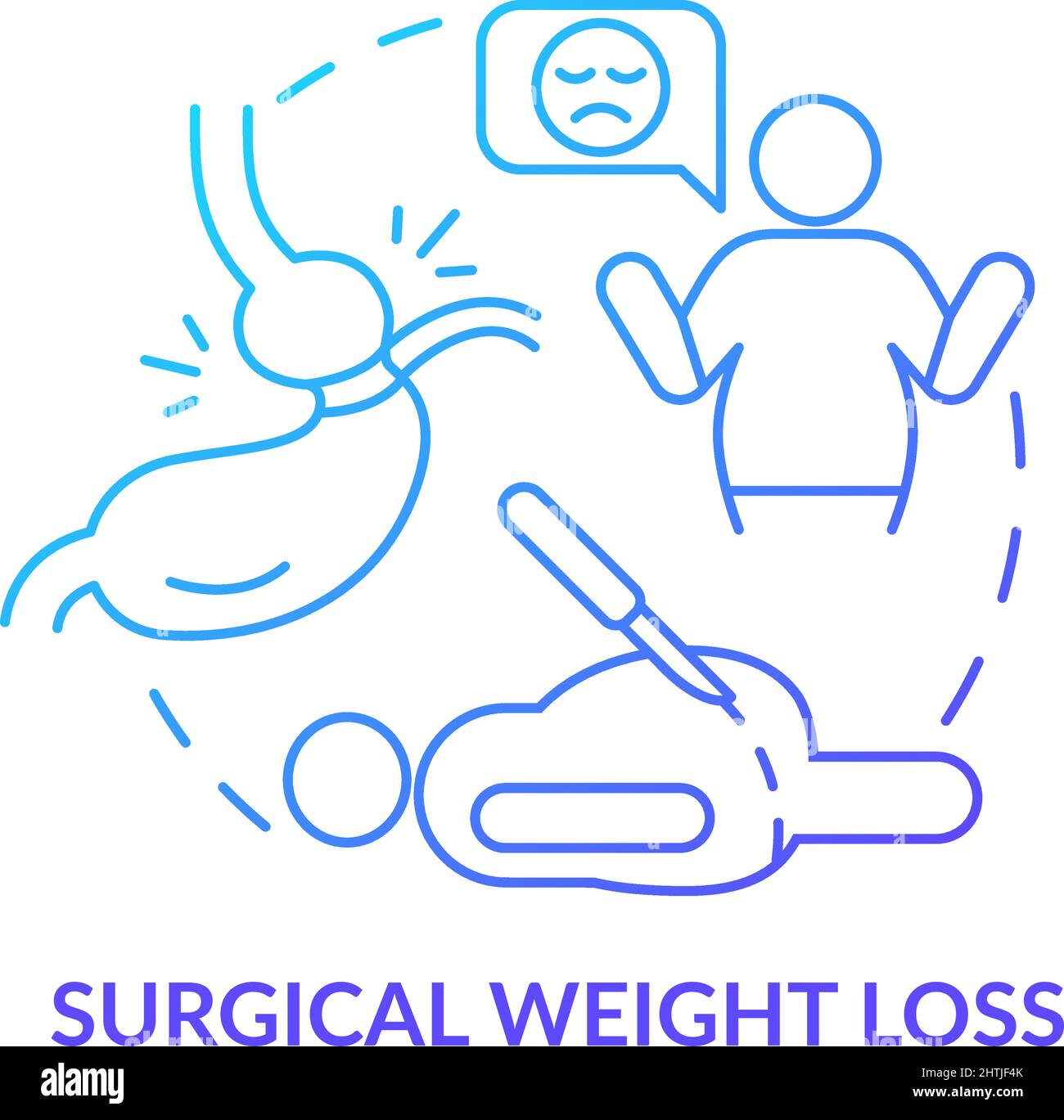 Surgical weight loss blue gradient concept icon Stock Vector Image ...