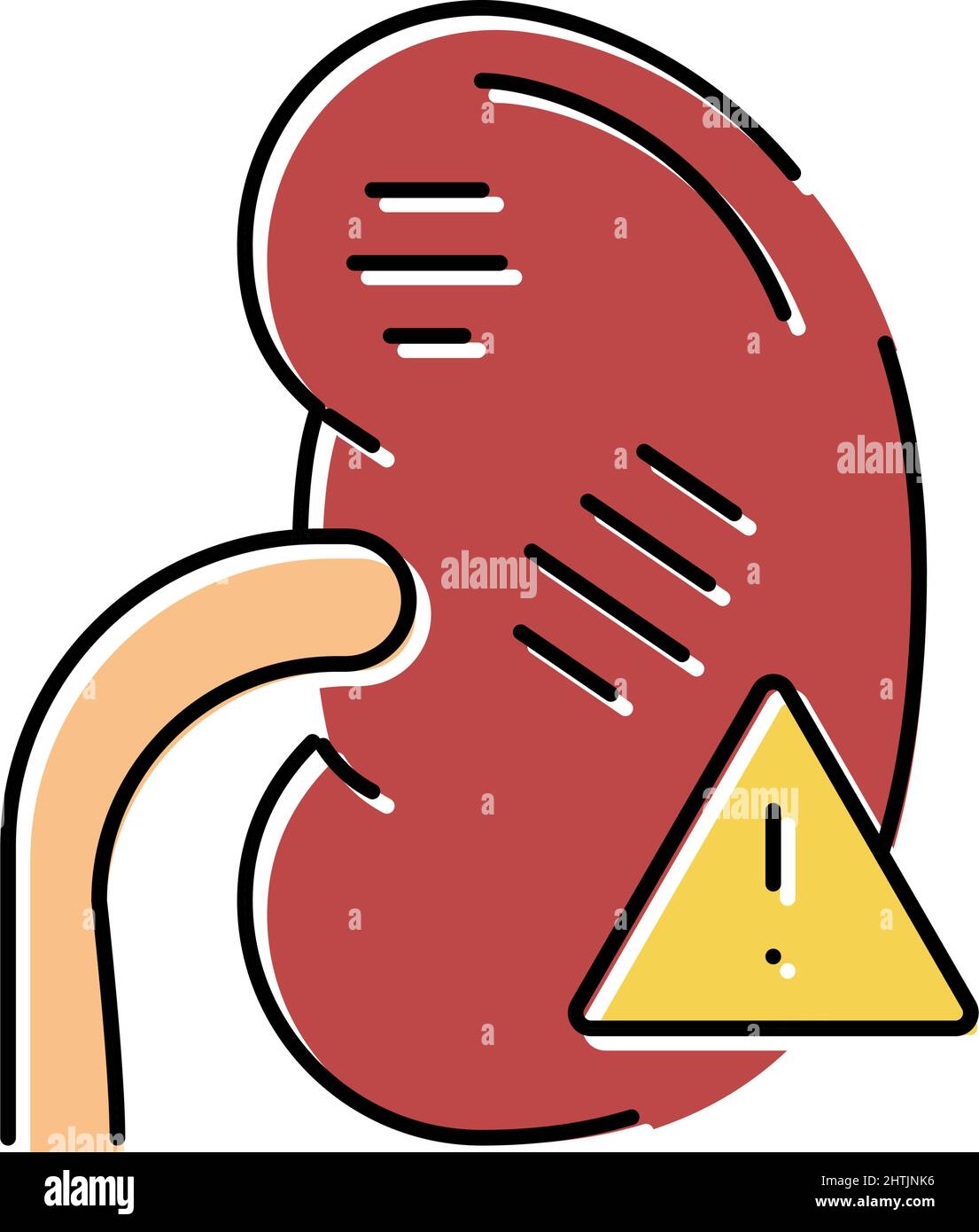 renal failure color icon vector illustration Stock Vector Image & Art ...