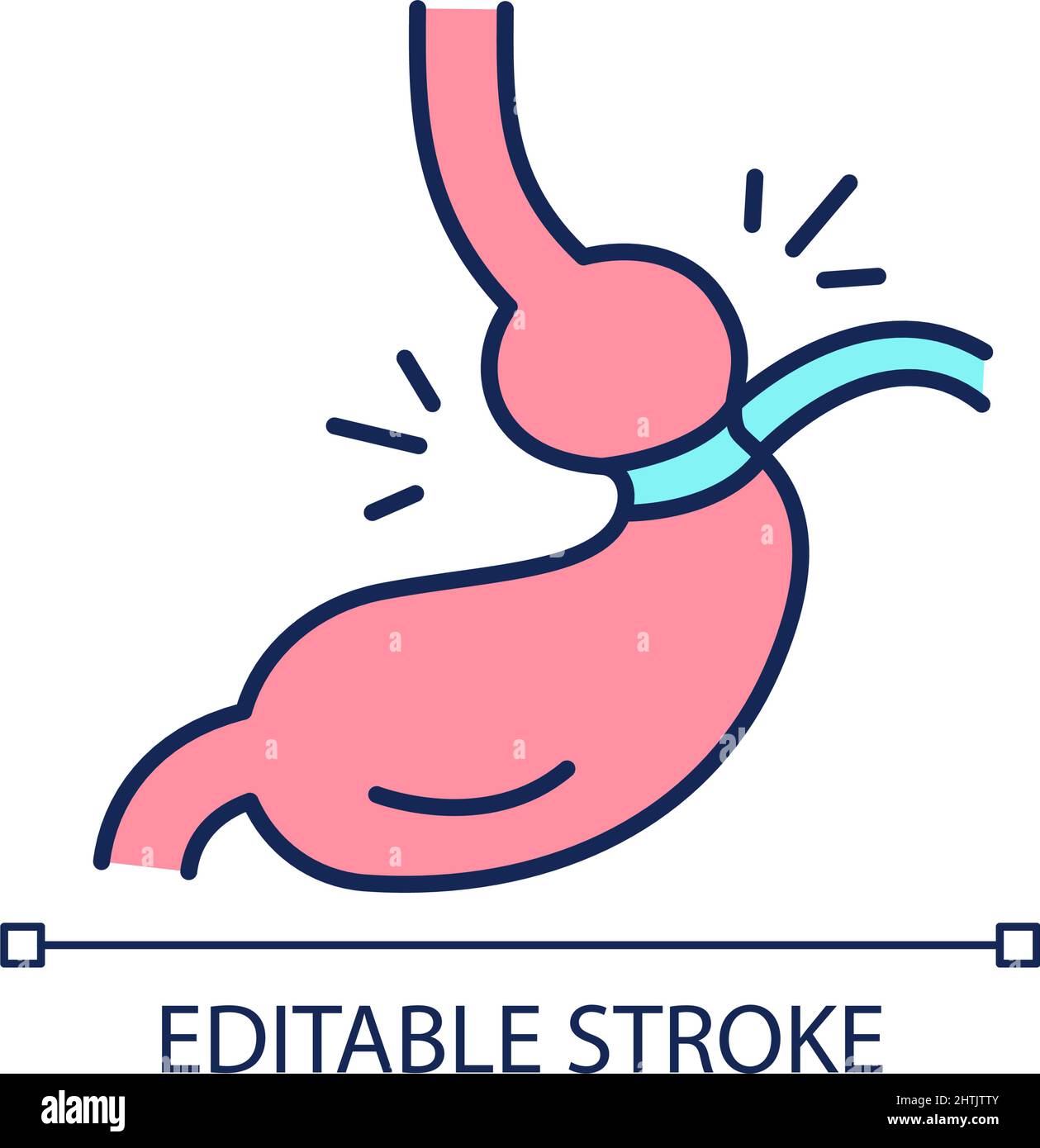 Gastric bypass hi-res stock photography and images - Alamy