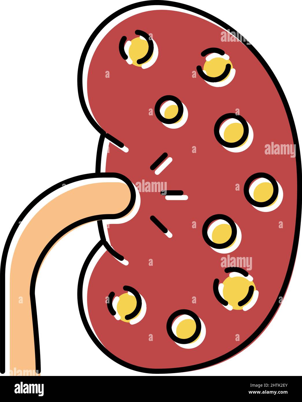 nephritis kidney color icon vector illustration Stock Vector Image ...