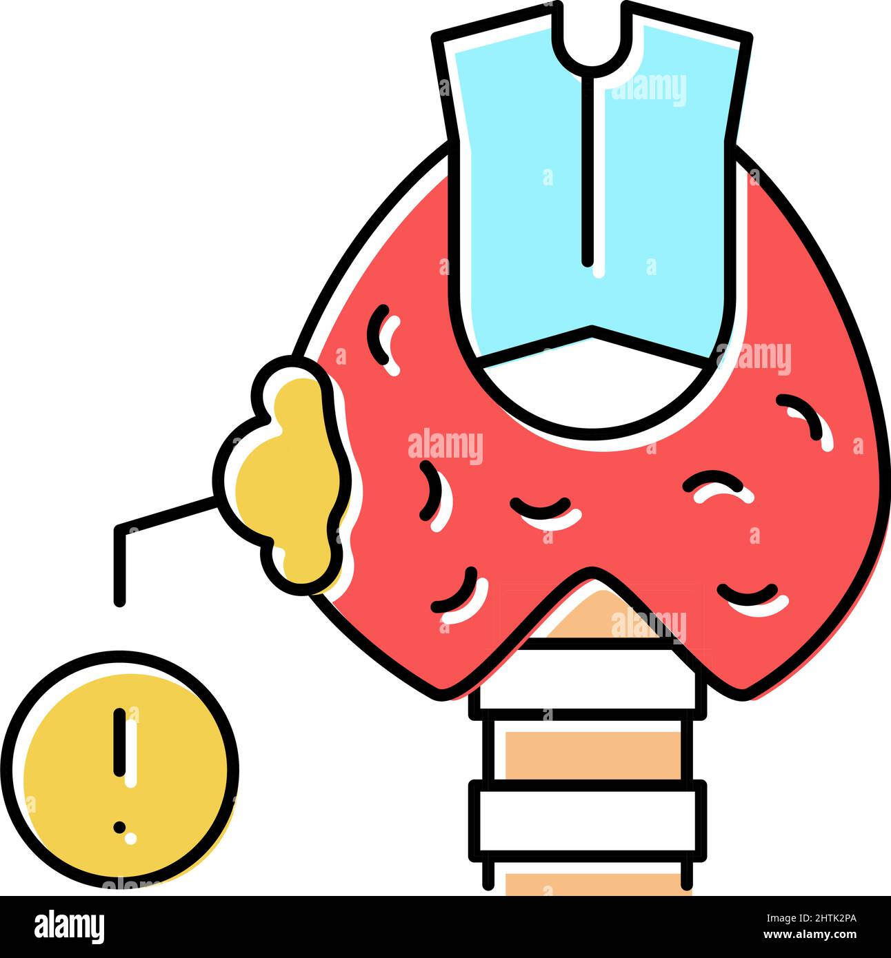 thyroid cancer color icon vector illustration Stock Vector Image & Art ...