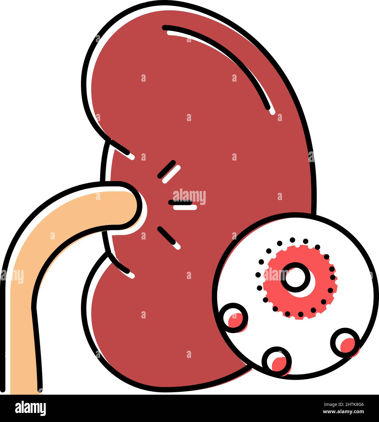 infection kidney color icon vector illustration Stock Vector Image ...