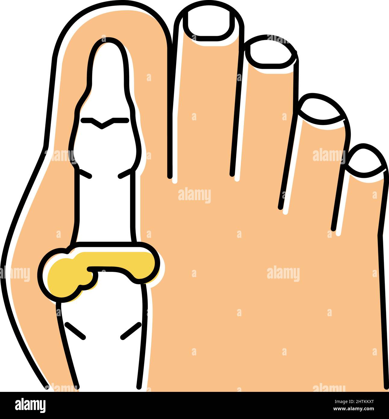 X ray of articular cartilage Stock Vector Images - Alamy