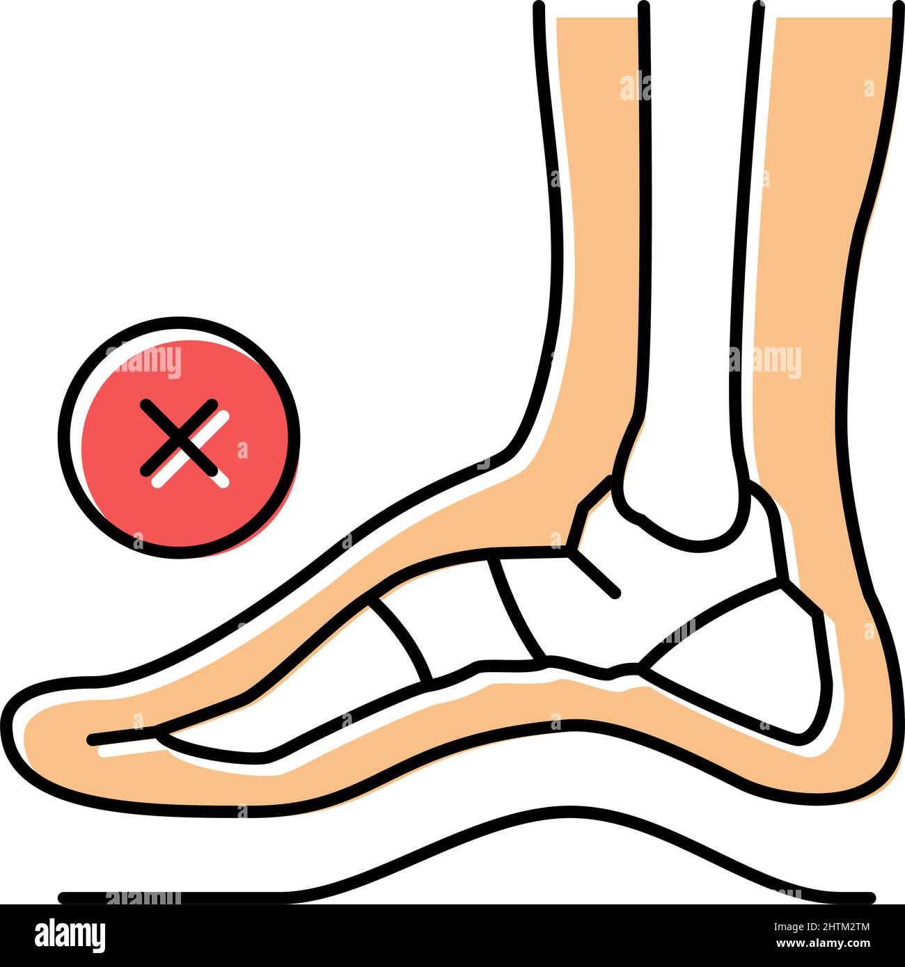 bone postural deformity feet color icon vector illustration Stock ...
