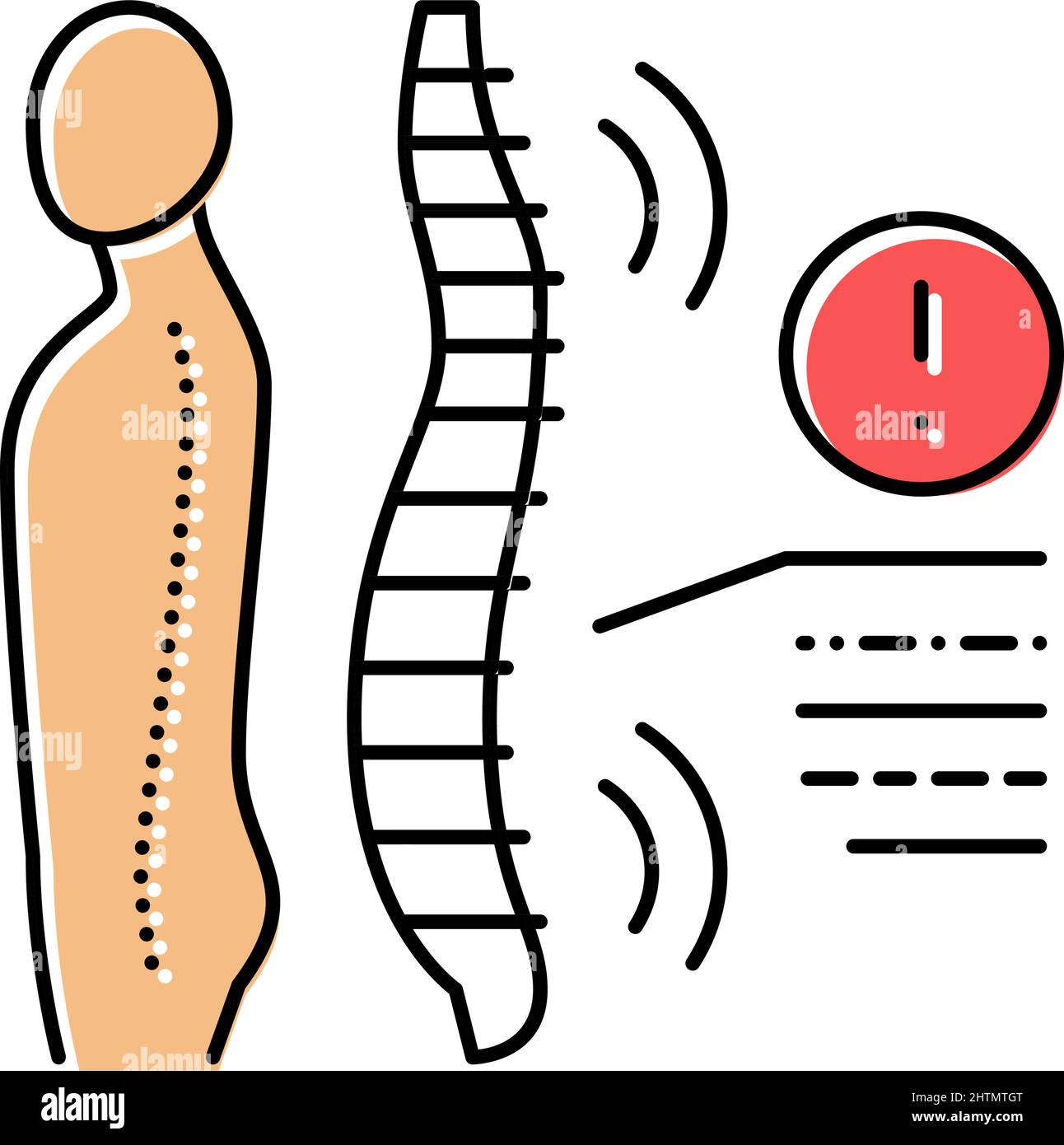 spondyloarthropathies health problem color icon vector illustration ... spondyloarthropathies health problem color icon vector illustration ...