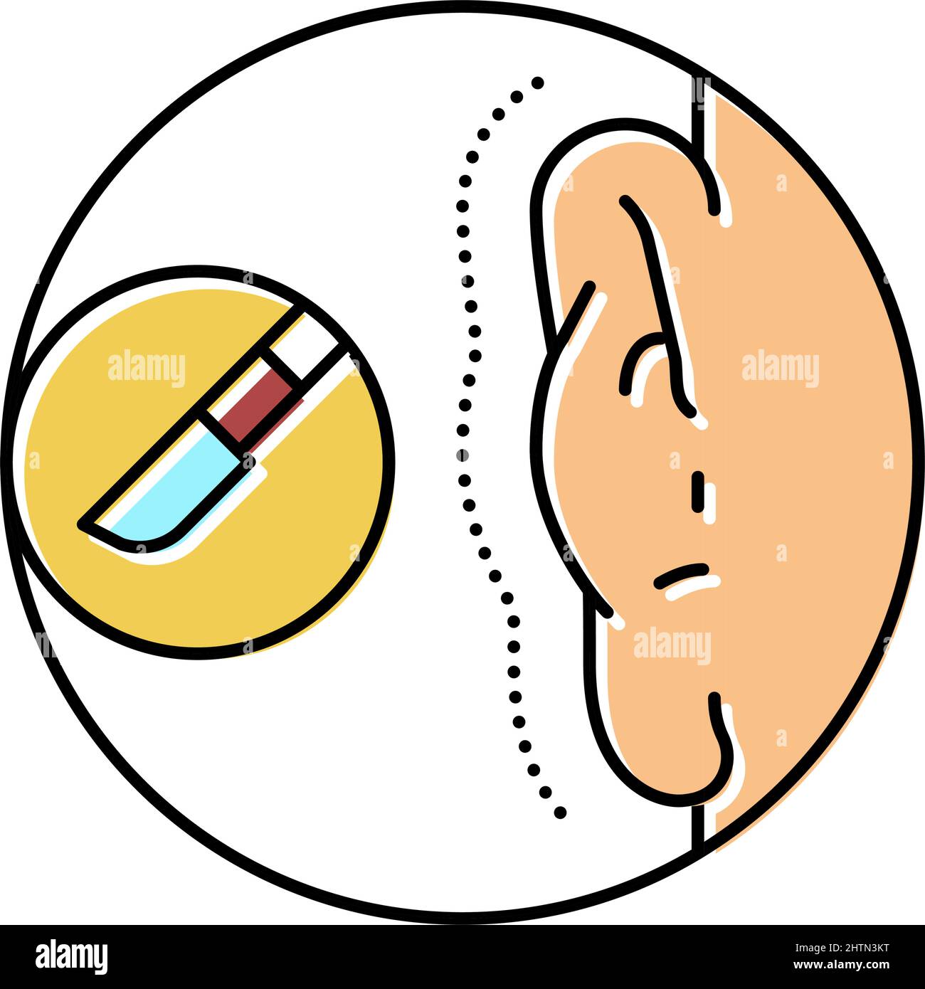 otoplasty surgery color icon vector illustration Stock Vector Image ...