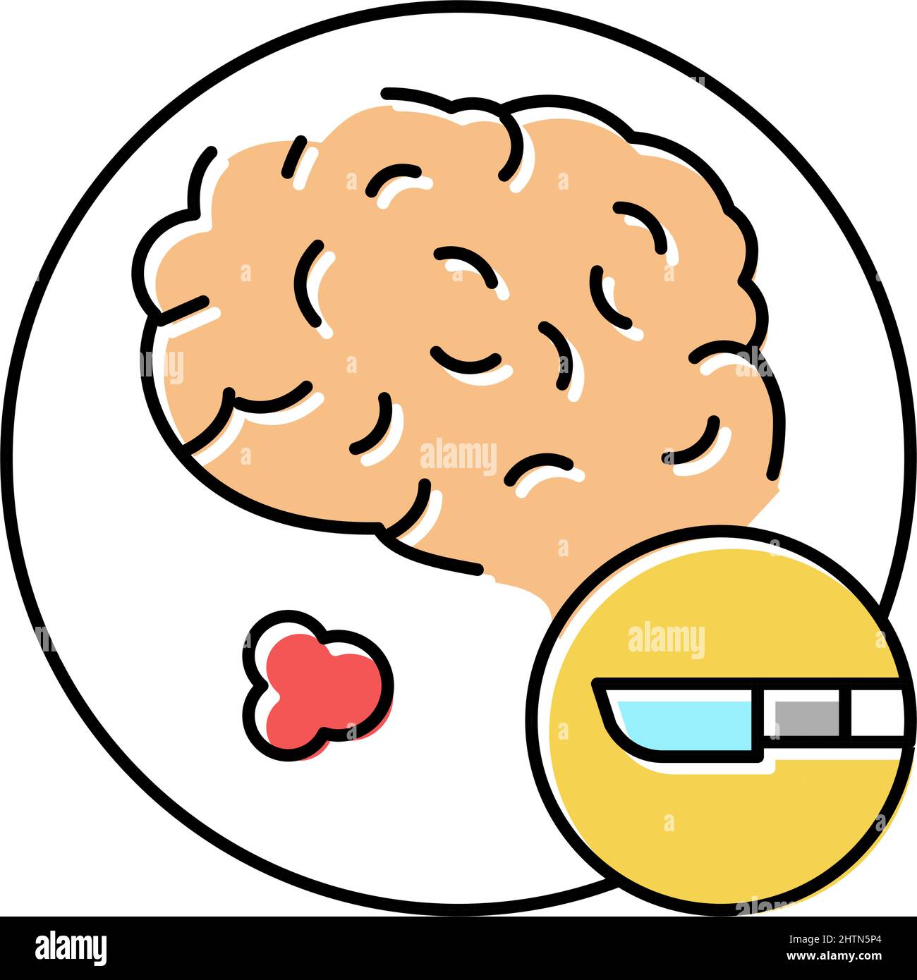 surgical operation brain stroke treatment color icon vector ...