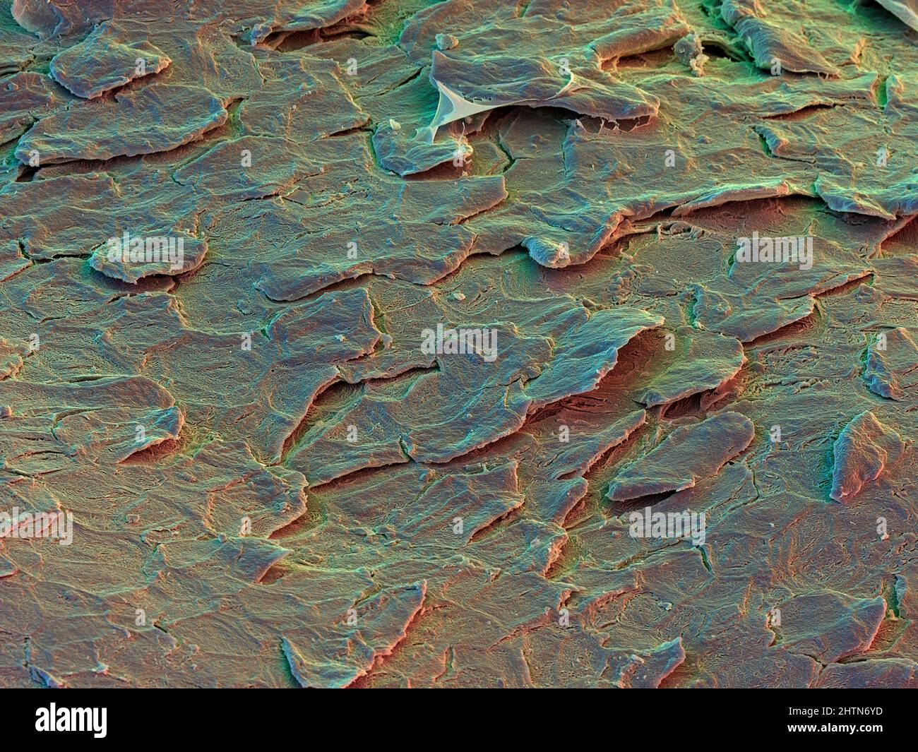 Human skin, SEM Stock Photo - Alamy