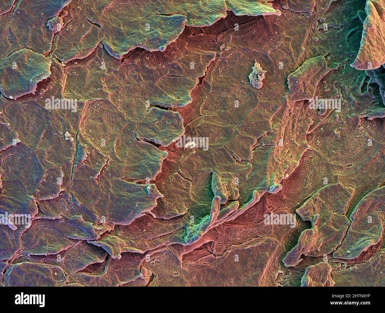 Human skin, SEM Stock Photo - Alamy