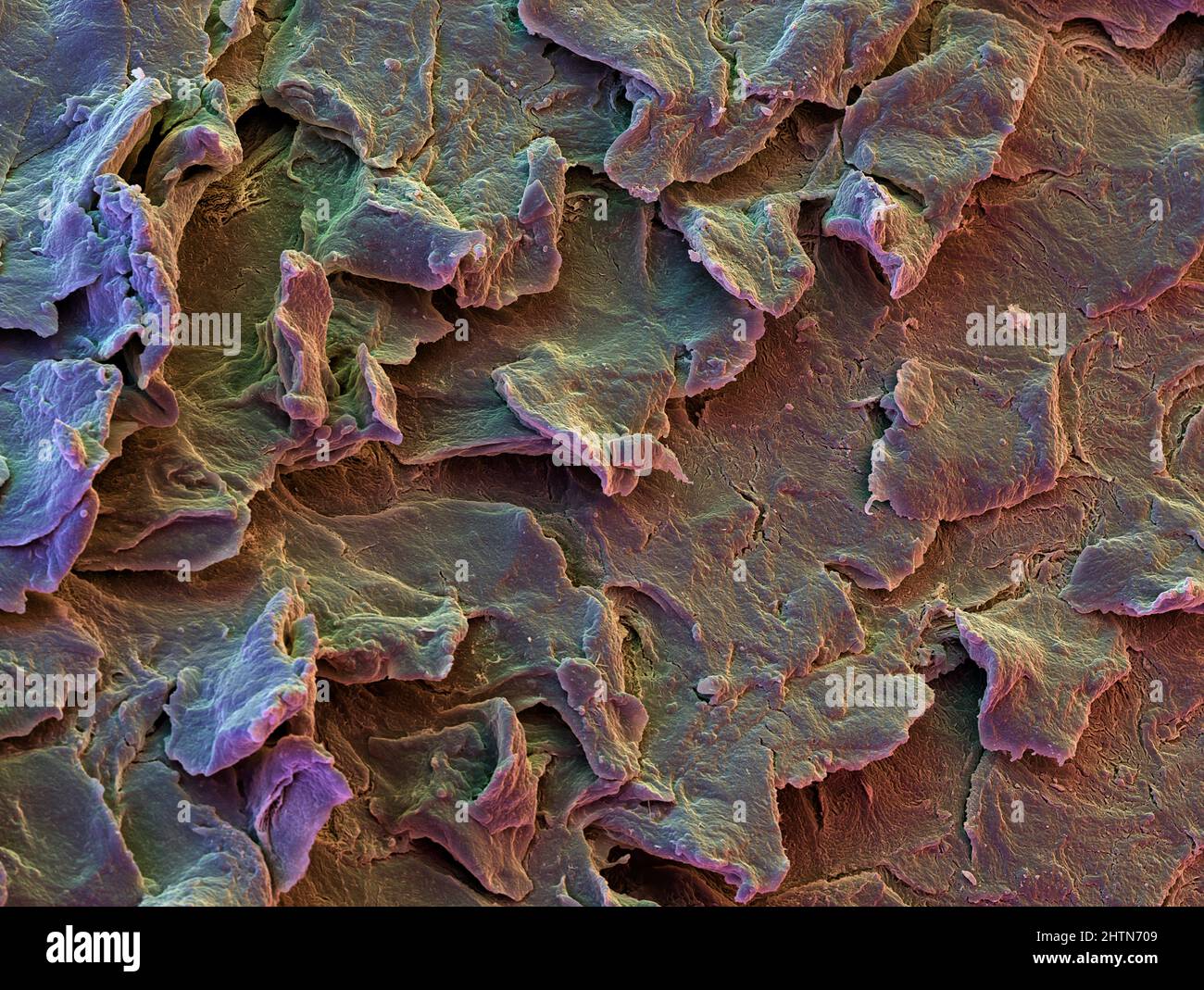 Human skin, SEM Stock Photo - Alamy