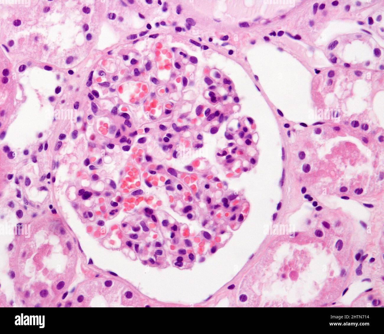 Renal Corpuscle Histology Labeled