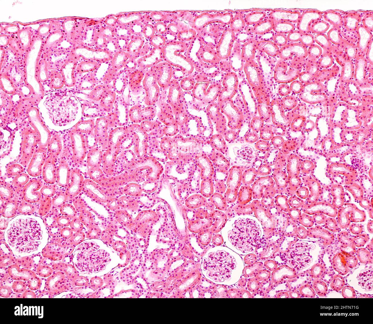 Kidney cortex, light micrograph Stock Photo - Alamy