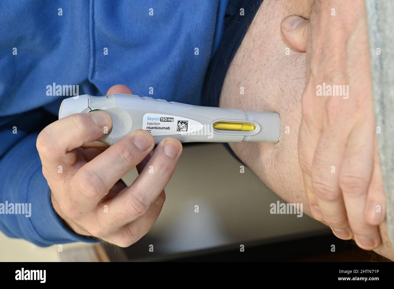 Risankizumab injection for psoriasis Stock Photo - Alamy