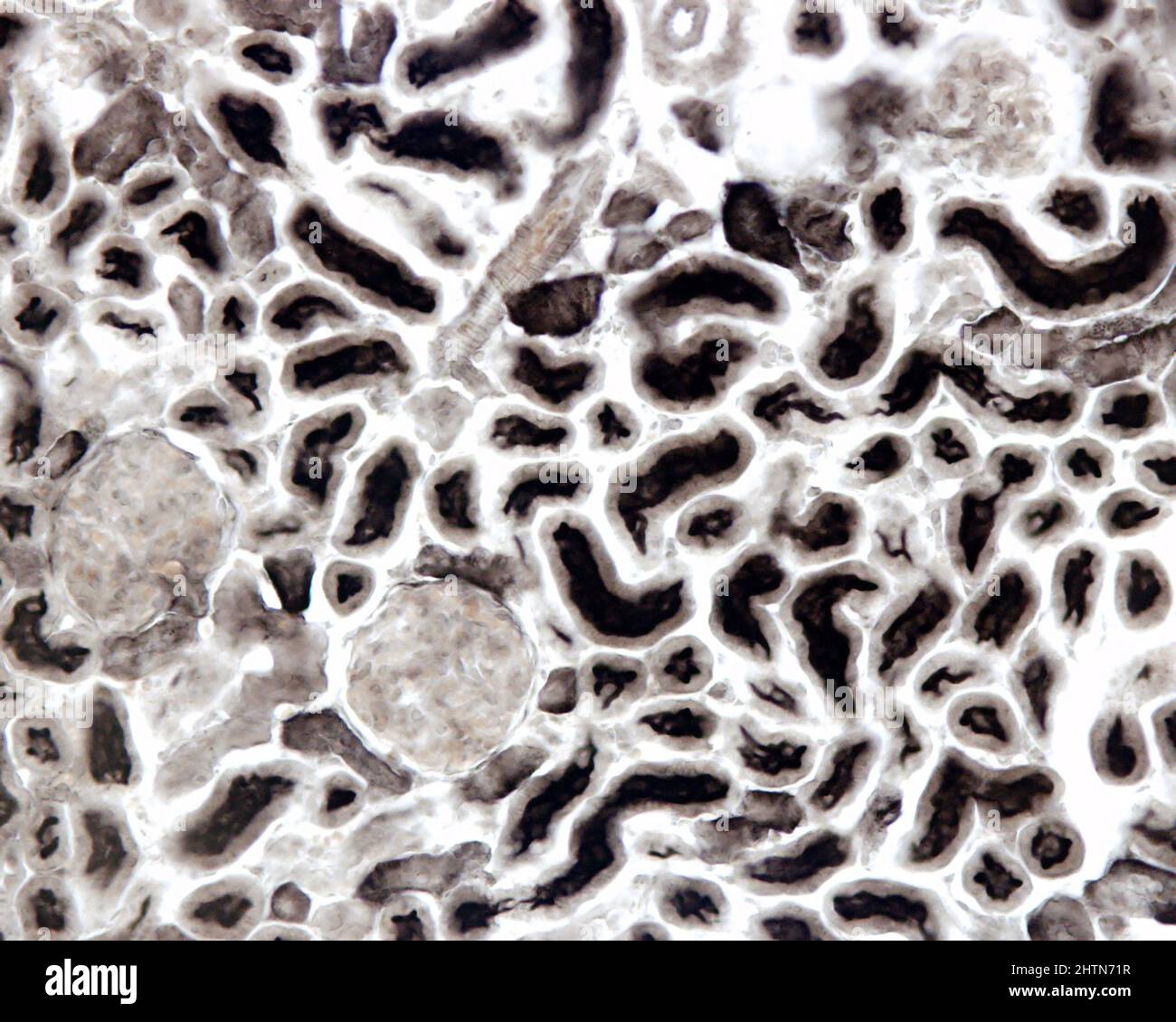 Kidney stained for alkaline phosphatase, light micrograph Stock Photo ...