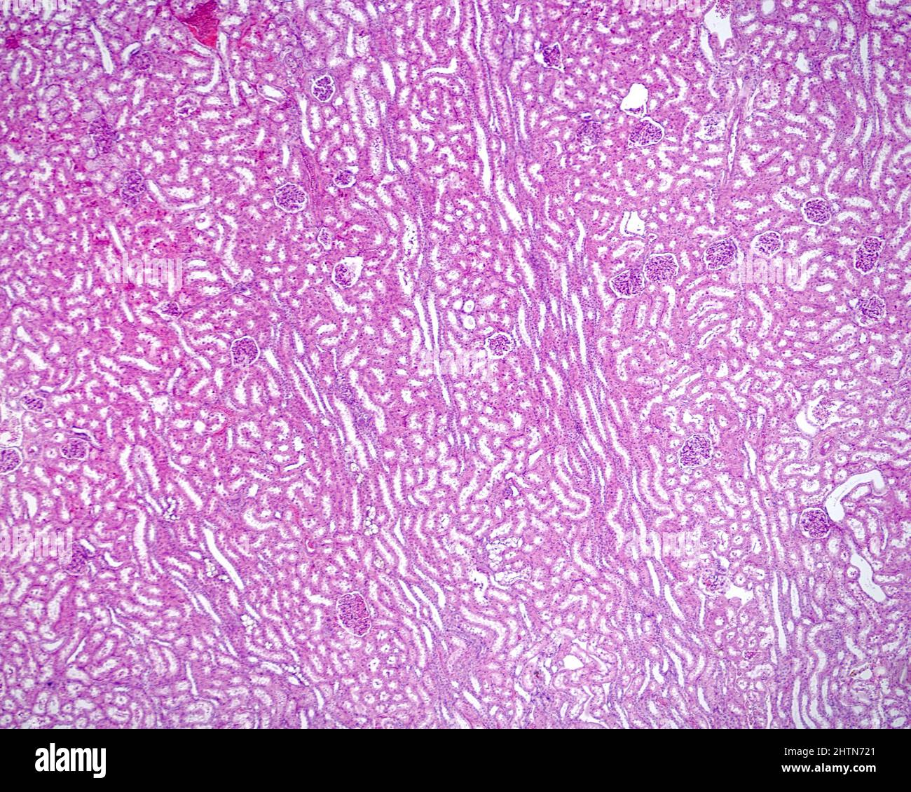 Kidney cortex, light micrograph Stock Photo - Alamy