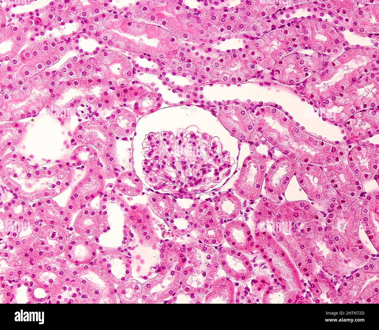 Medullary rays in kidney cortex, light micrograph Stock Photo - Alamy