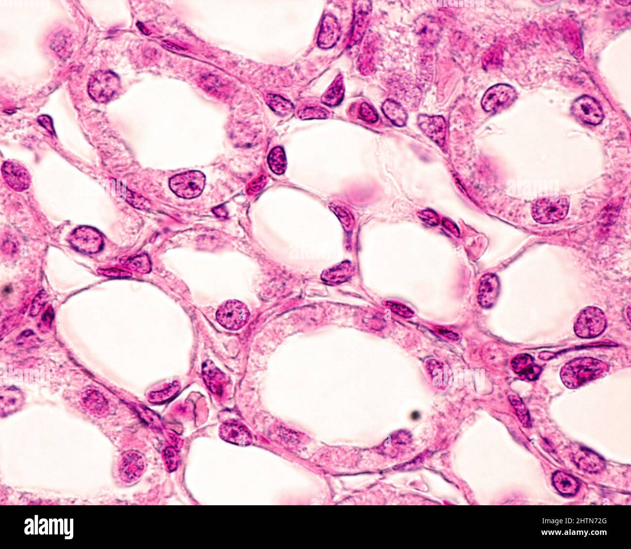 Kidney tubules and loops of Henle, light micrograph Stock Photo - Alamy