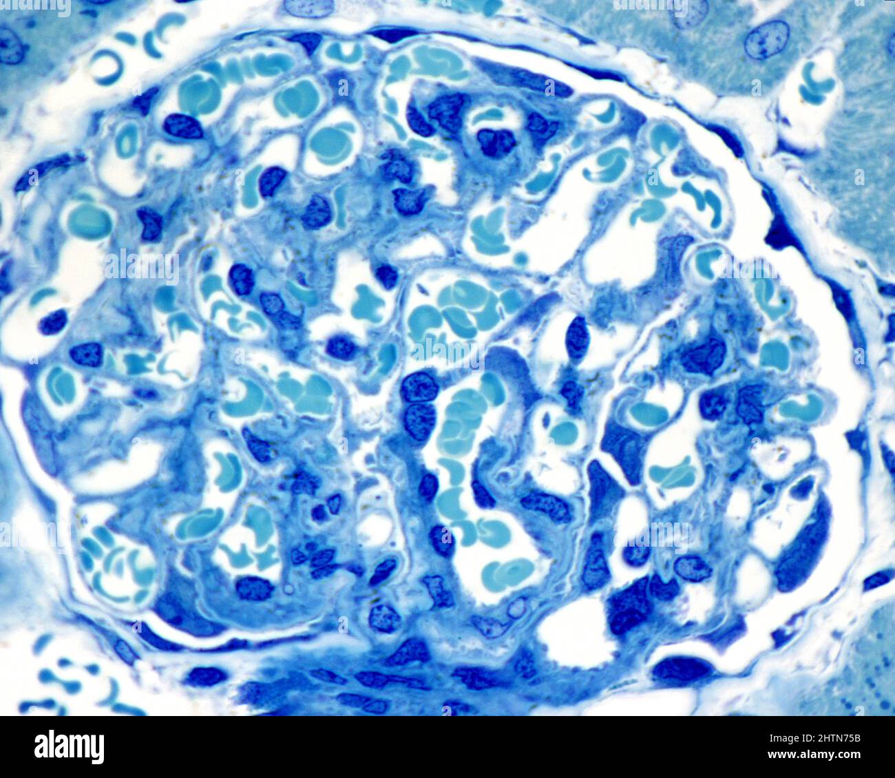 Kidney cortex, light micrograph Stock Photo - Alamy