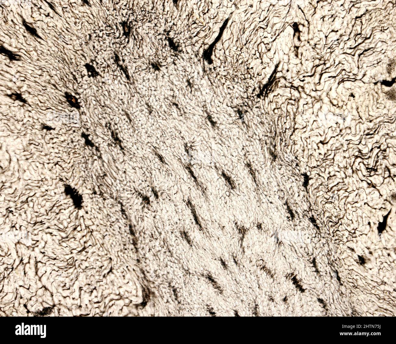 Kidney medulla blood vessels, light micrograph Stock Photo - Alamy