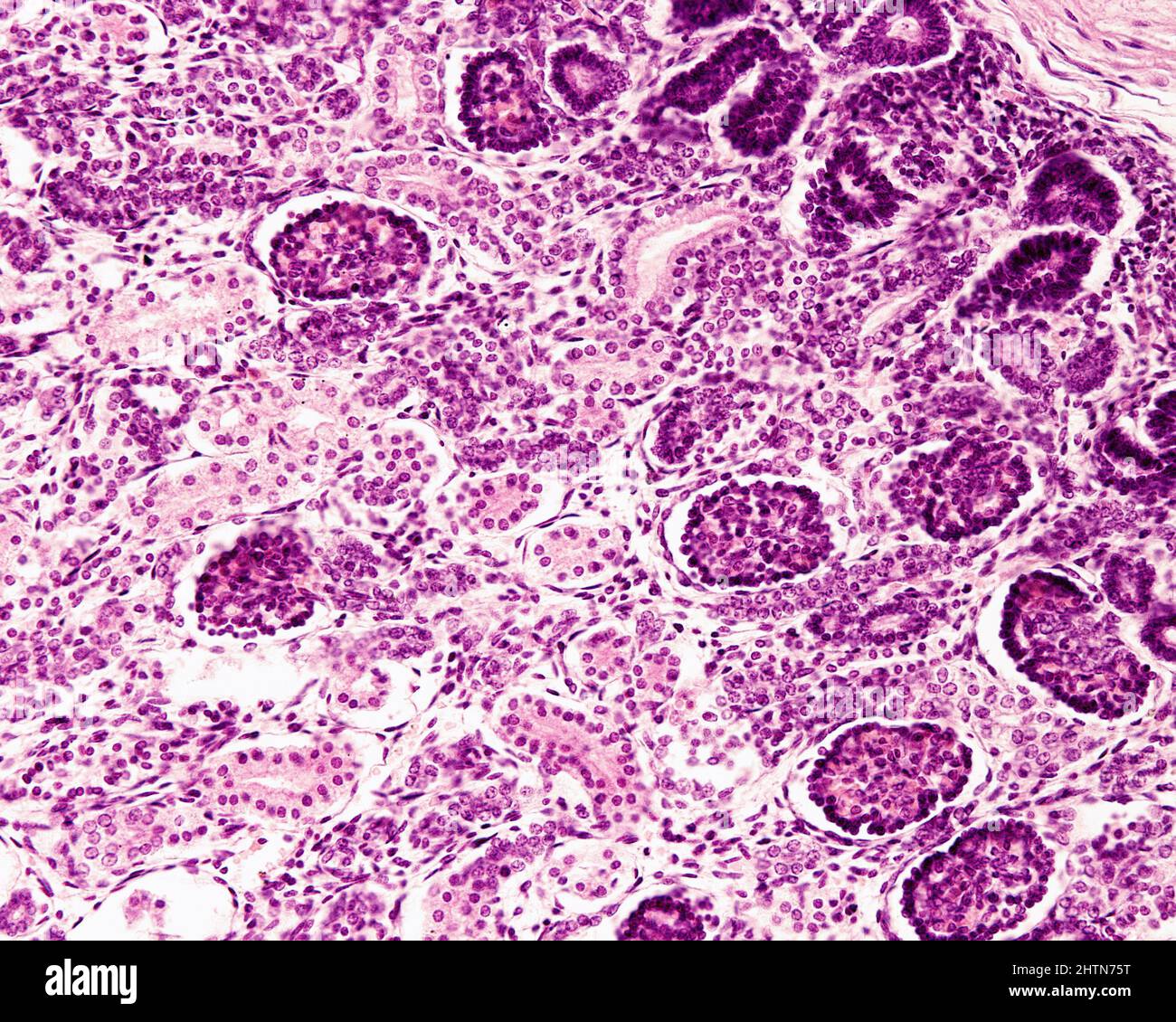Human foetal kidney corpuscle development, light micrograph Stock Photo ...