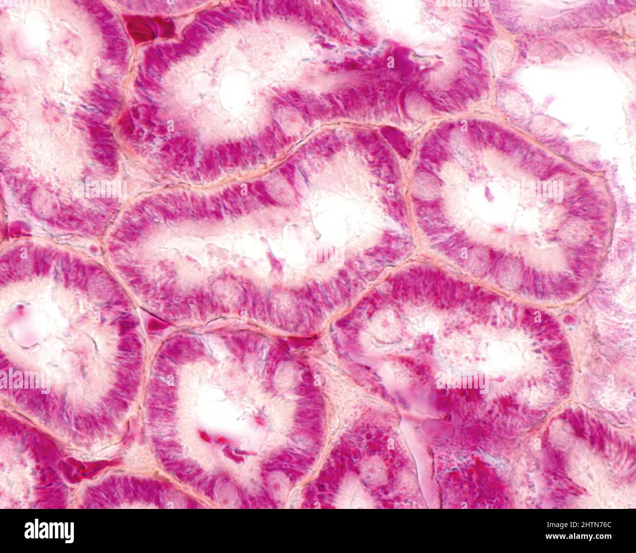Mitochondria in kidney convoluted tubules, light micrograph Stock Photo ...