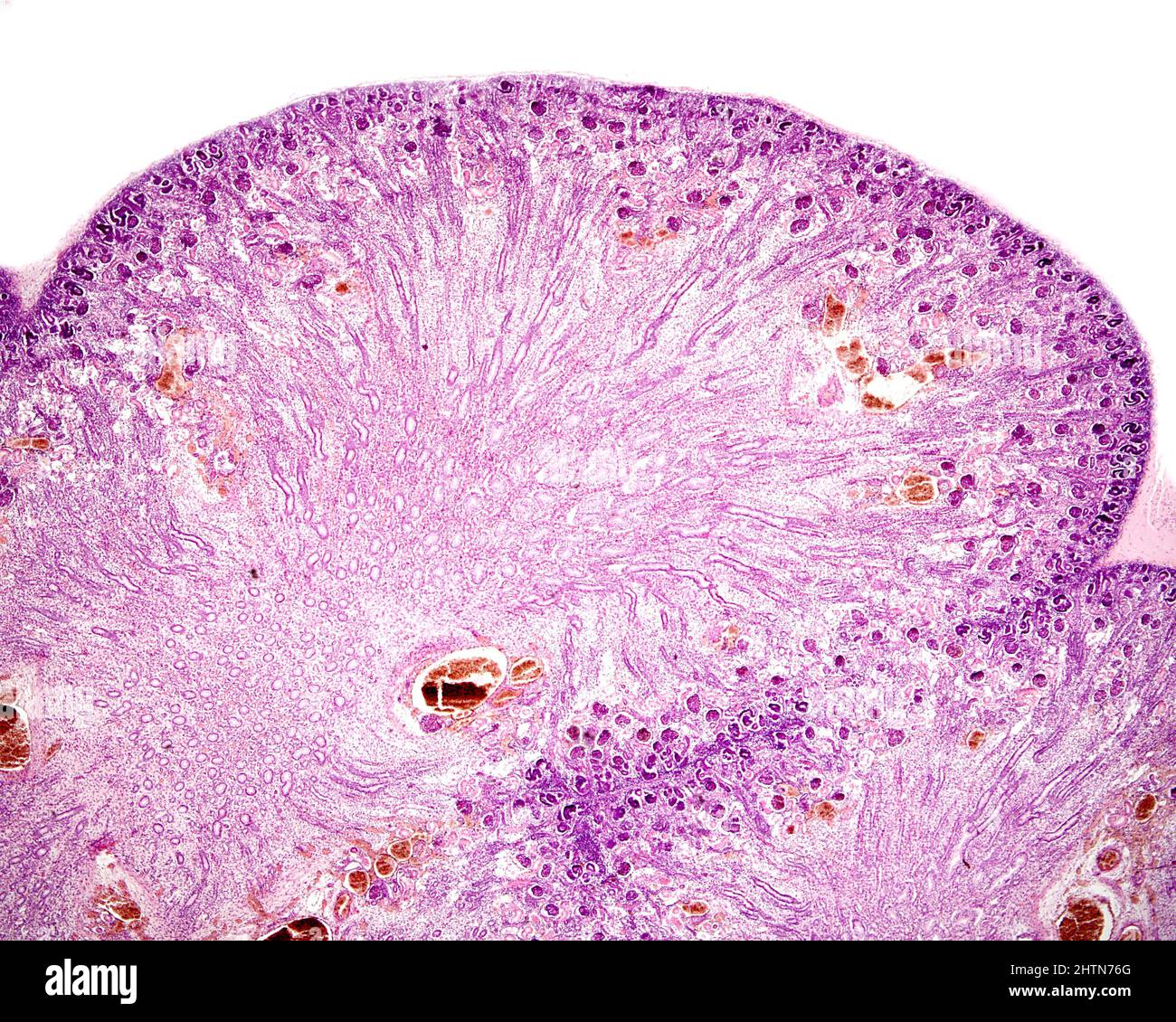 Kidney development, light micrograph Stock Photo - Alamy
