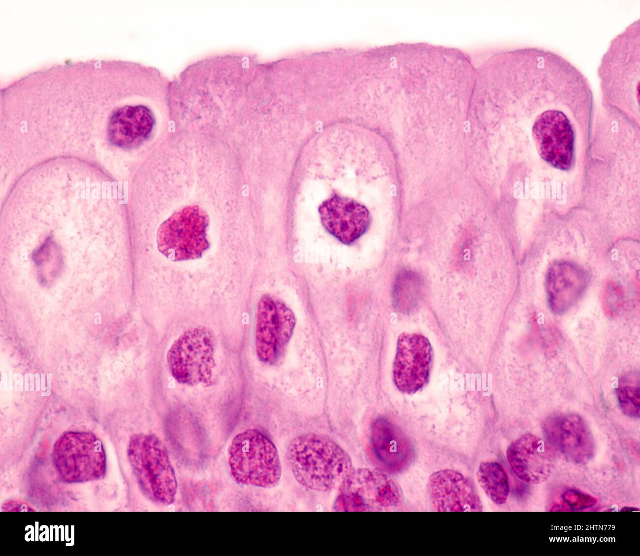 Urinary bladder epithelium, light micrograph Stock Photo - Alamy