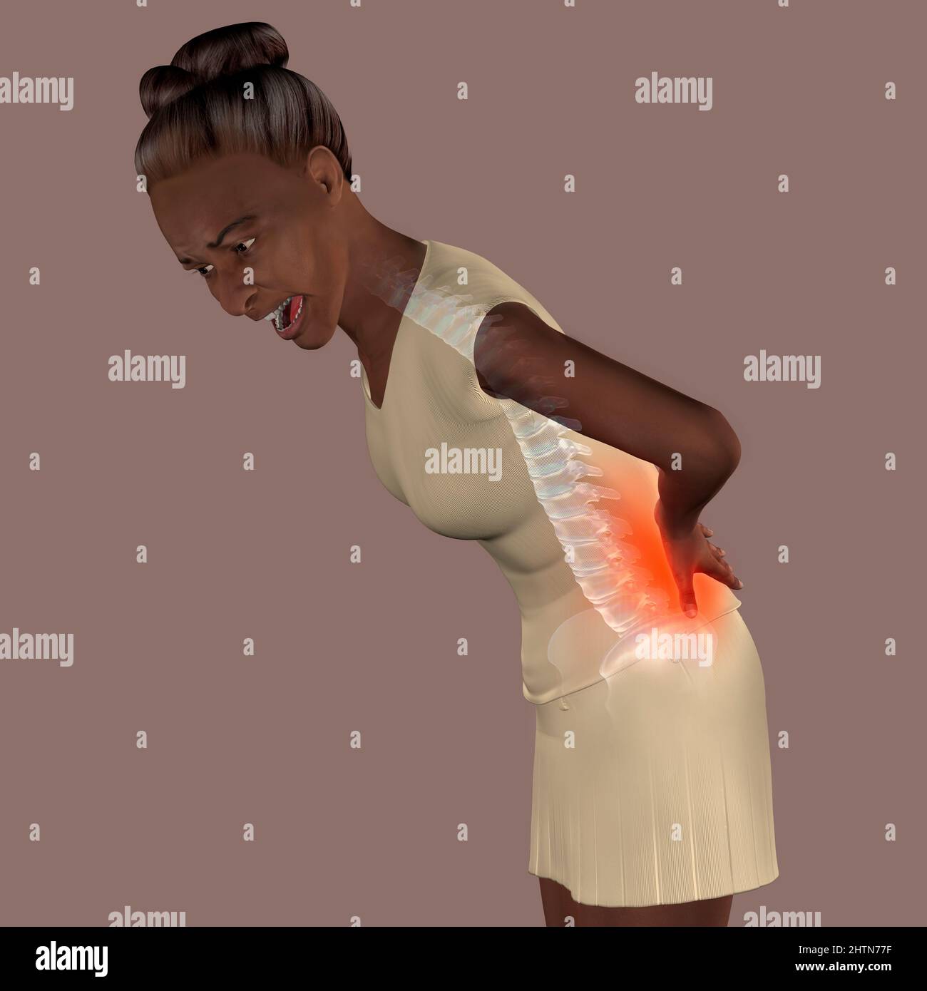 Woman with lower back pain, illustration Stock Photo - Alamy
