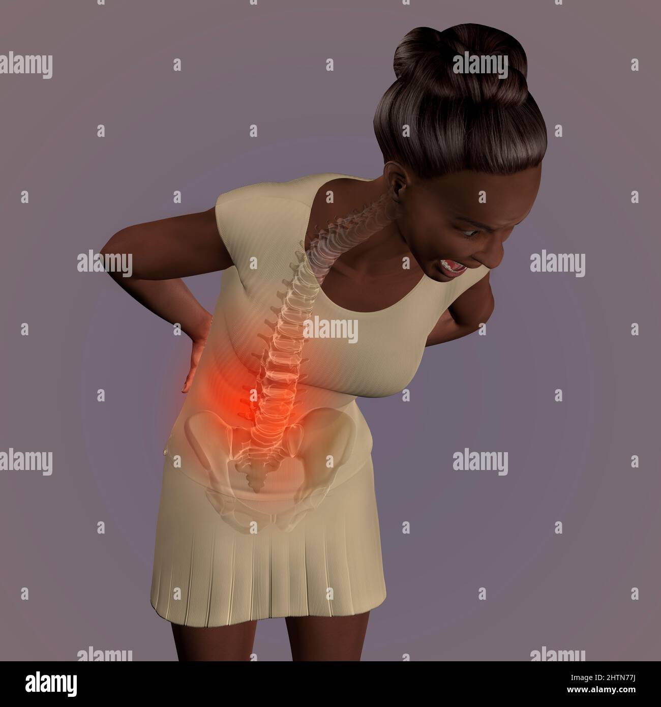 Woman with lower back pain, illustration Stock Photo - Alamy