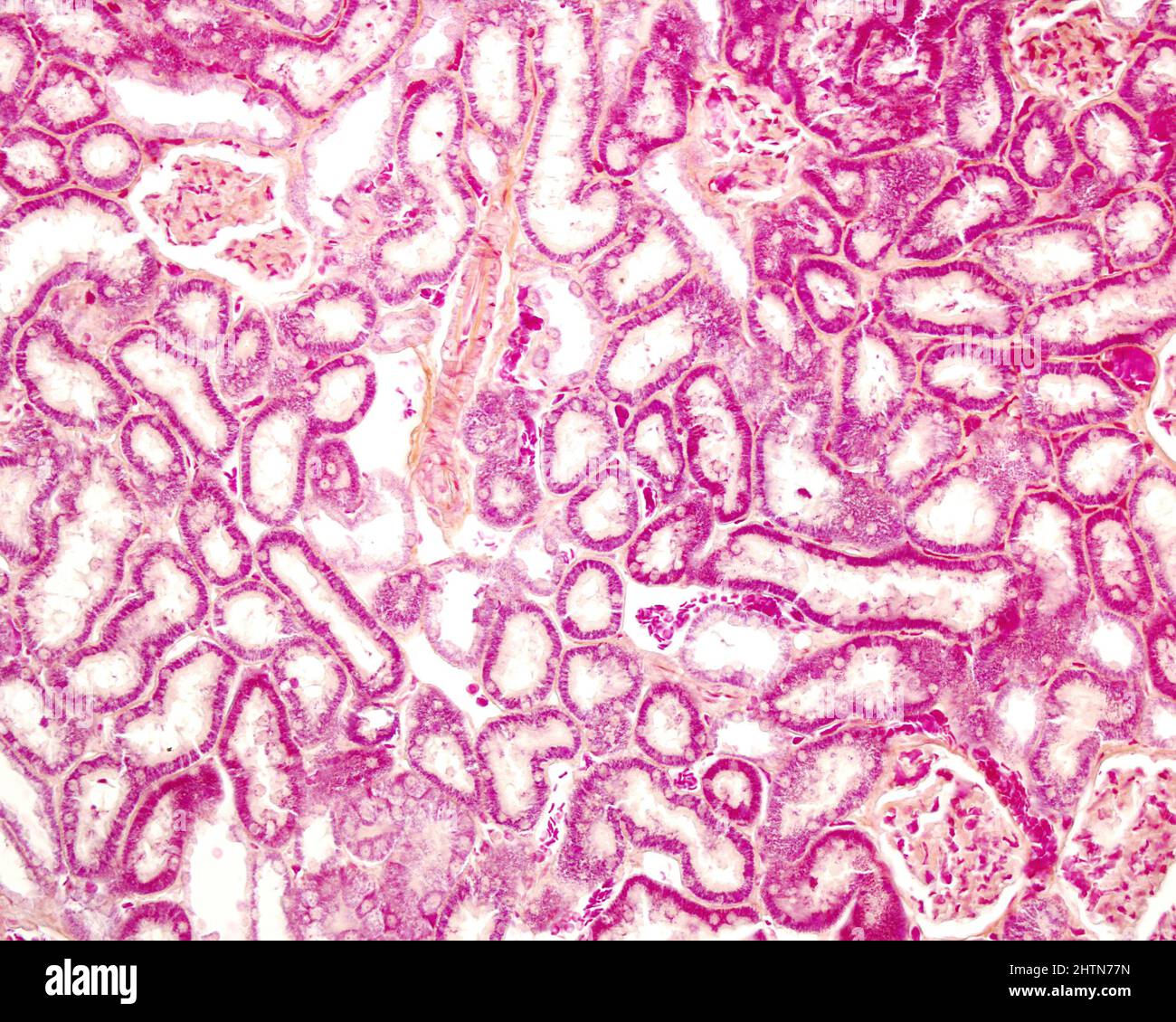 Mitochondria in kidney convoluted tubules, light micrograph Stock Photo ...