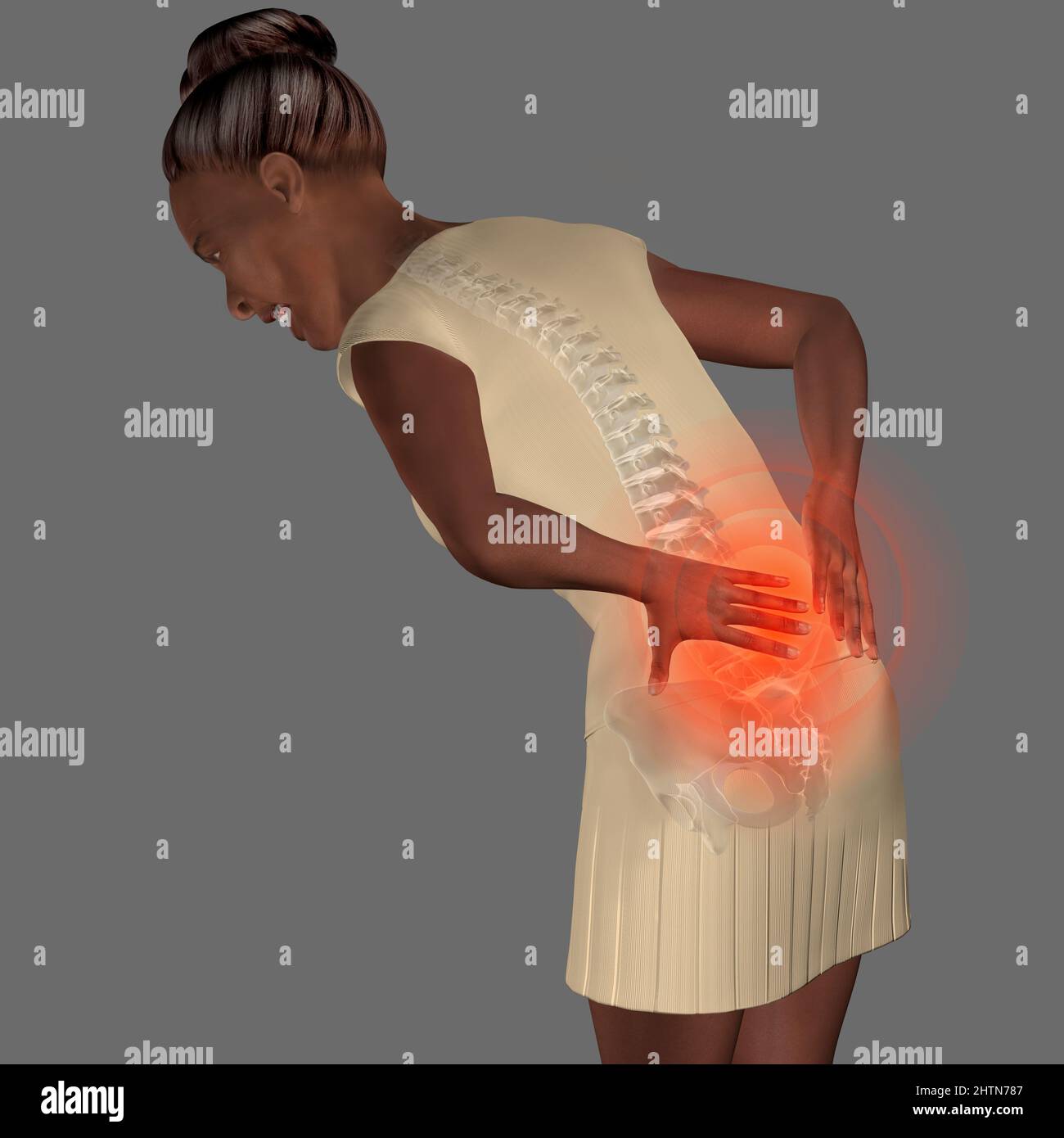 Woman with lower back pain, illustration Stock Photo - Alamy