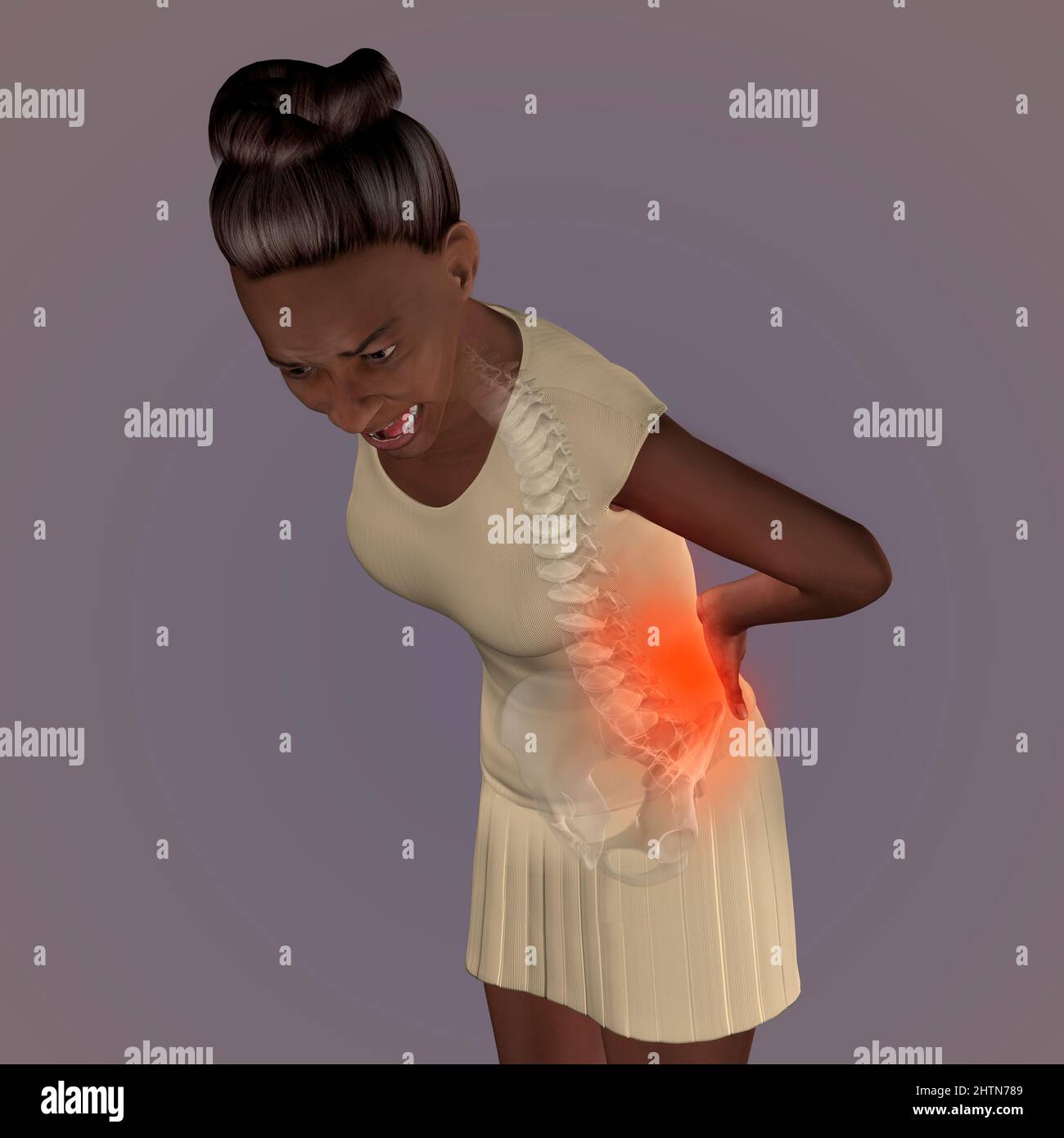 Woman with lower back pain, illustration Stock Photo - Alamy