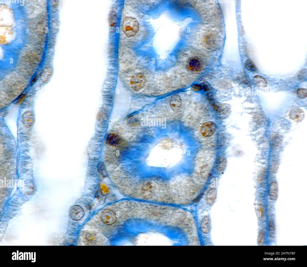 Kidney stained with Malloryâ€™s trichrome, light micrograph Stock Photo ...