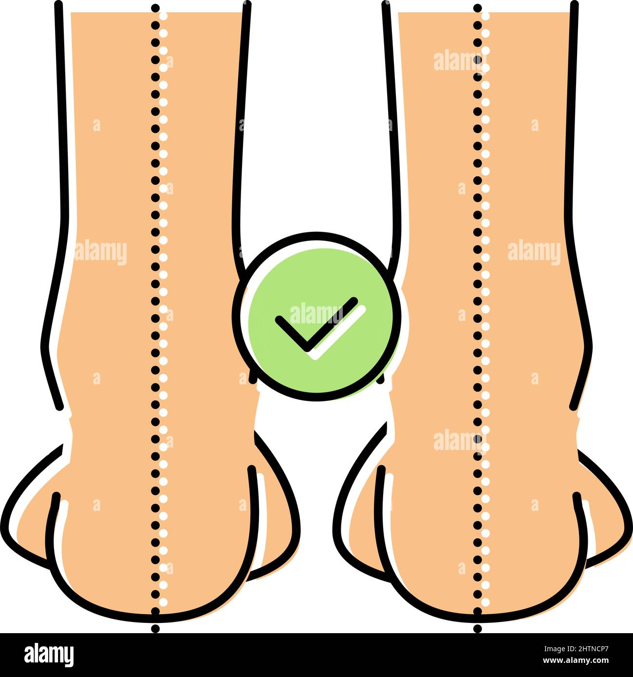 Genetic deformity Stock Vector Images - Alamy