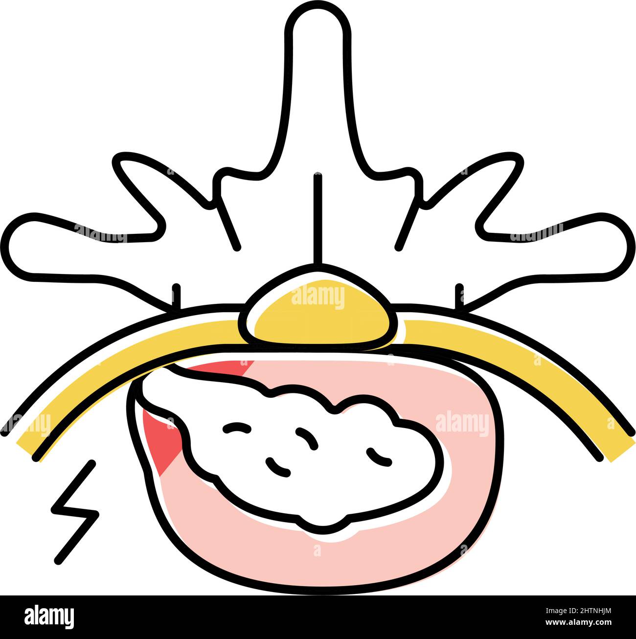 Diskectomy patient disease line icon Stock Vector Images - Alamy