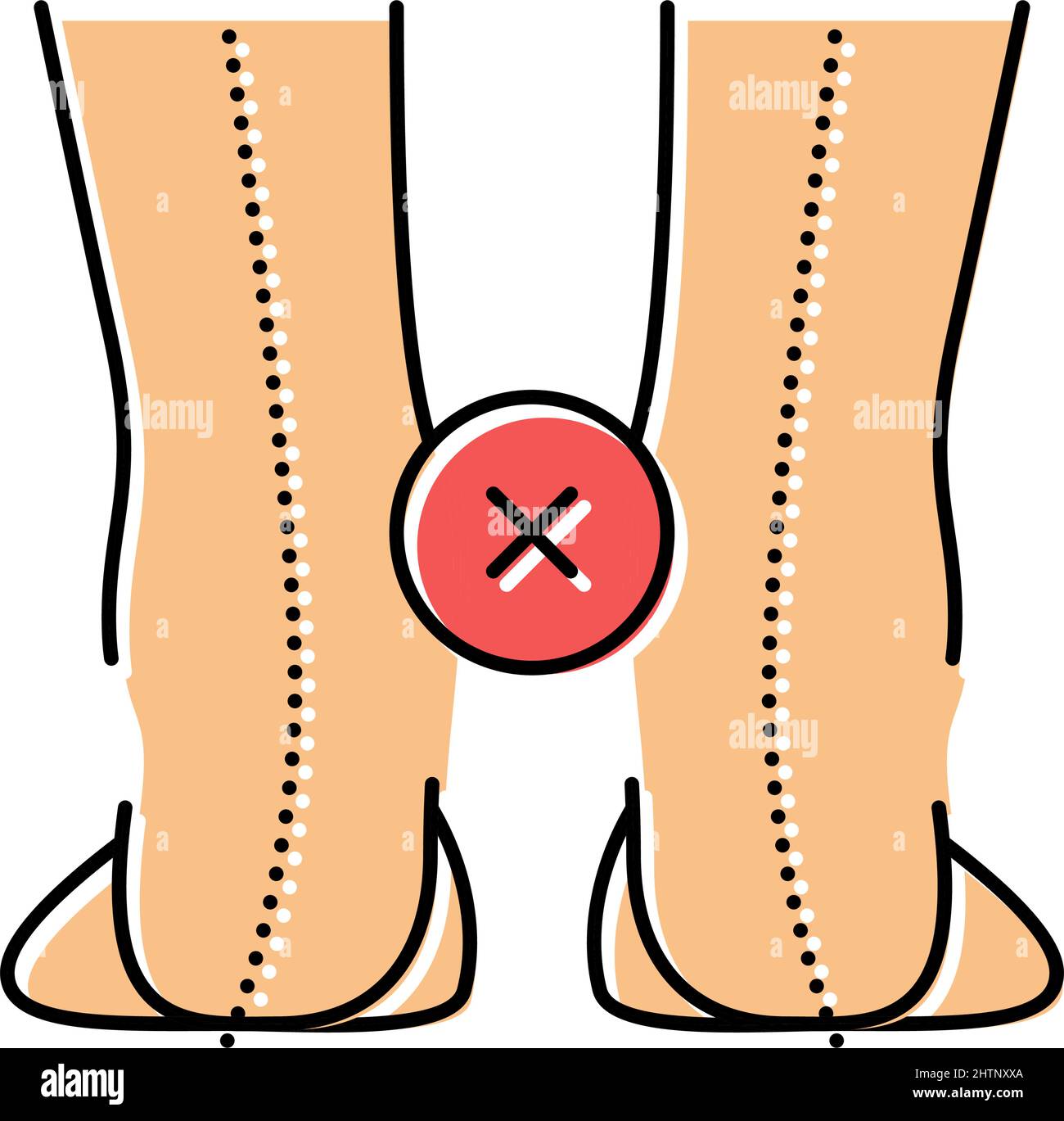 curvature of legs inward color icon vector illustration Stock Vector ...