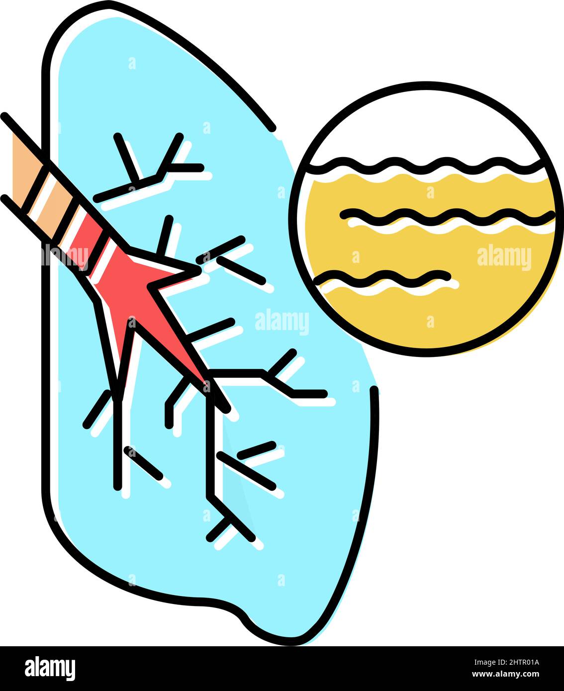 bronchitis disease color icon vector illustration Stock Vector Image ...