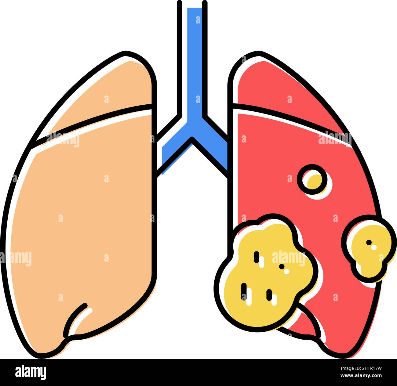 acute respiratory distress syndrome color icon vector illustration ...