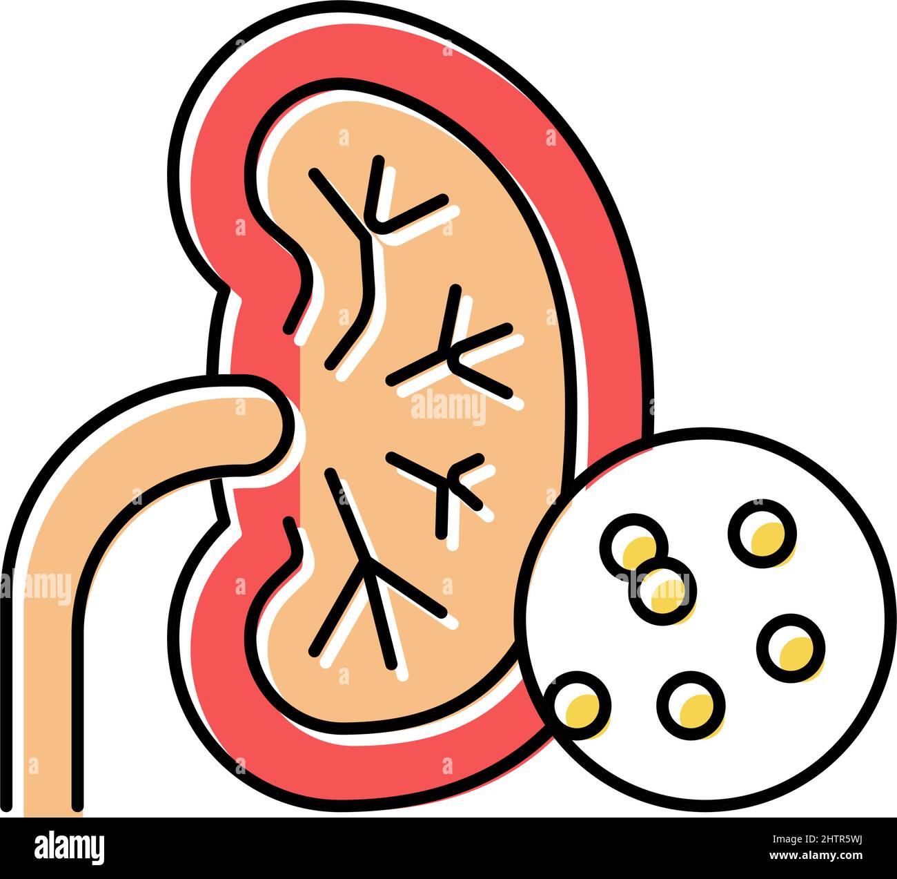 kidneys problem color icon vector illustration Stock Vector Image & Art ...