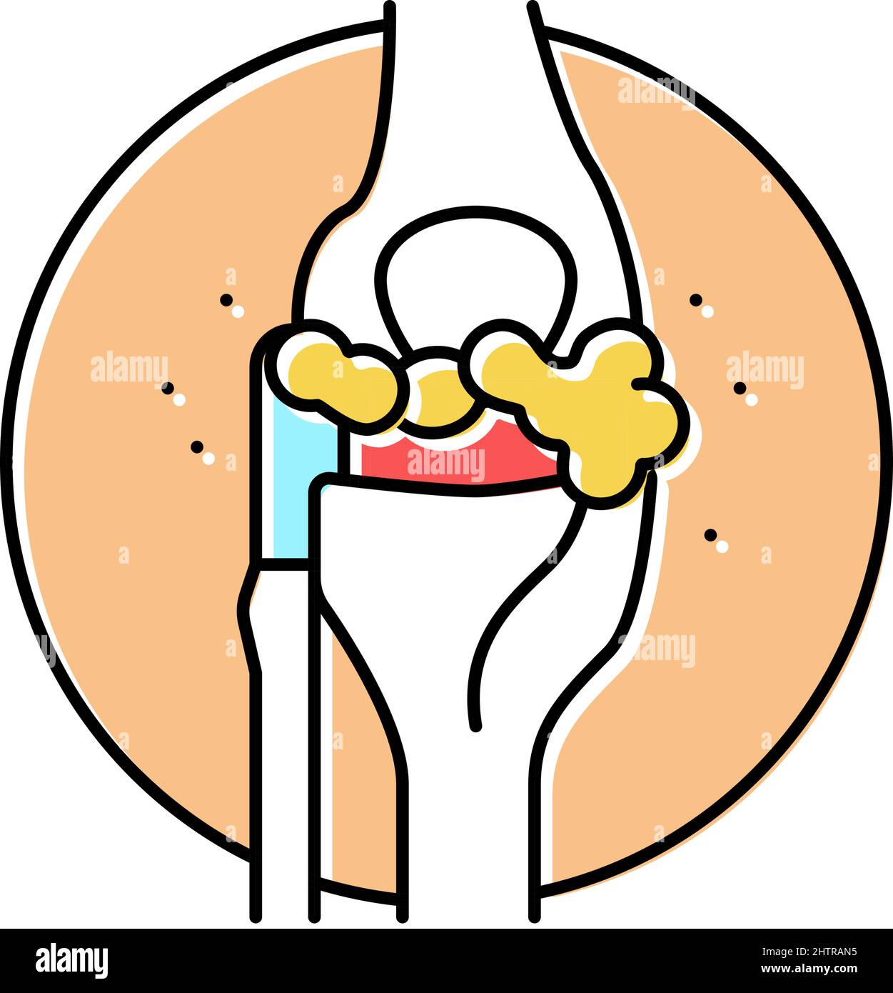 lumps around joints color icon vector illustration Stock Vector Image ...