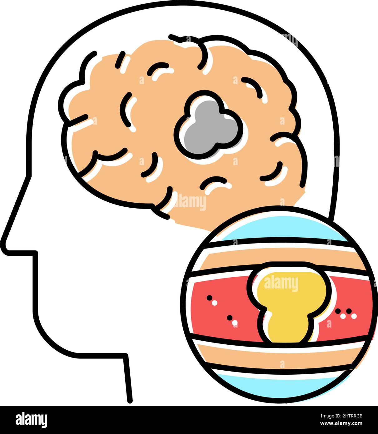 brain vessel congestion color icon vector illustration Stock Vector ...