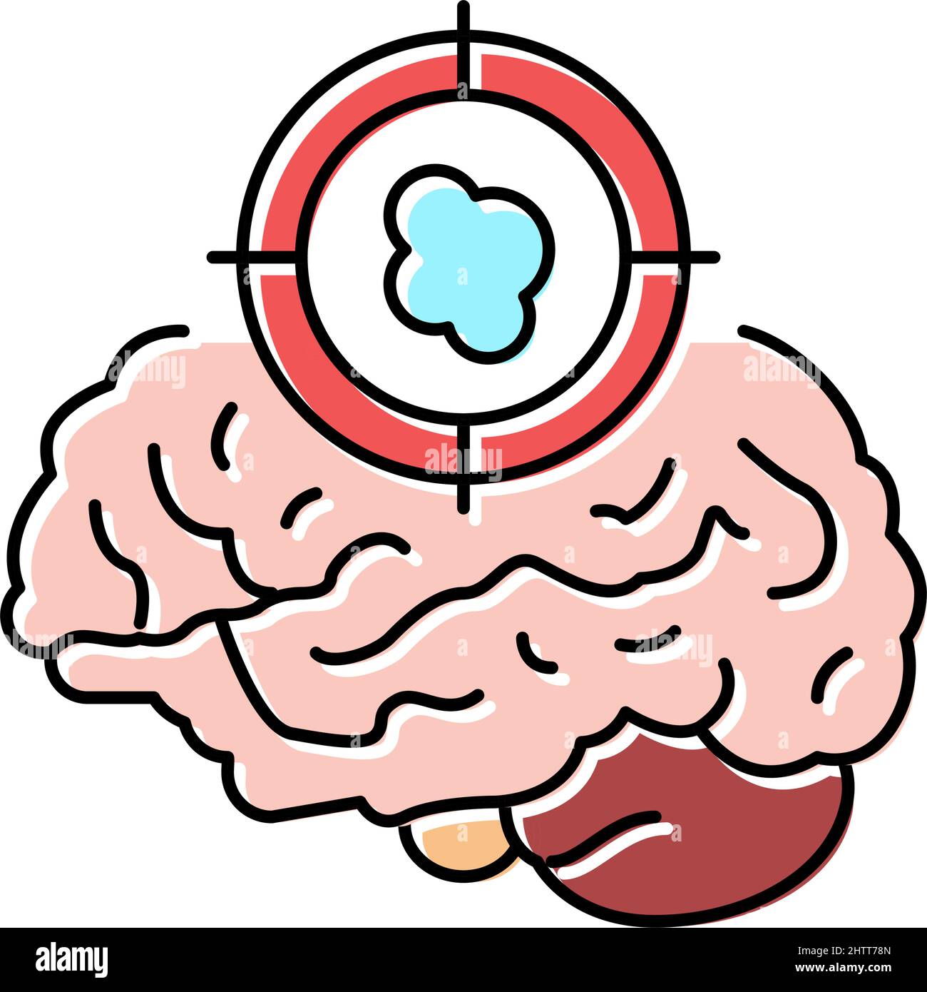 tumor removal color icon vector illustration Stock Vector Image & Art ... tumor removal color icon vector illustration Stock Vector Image & Art ...